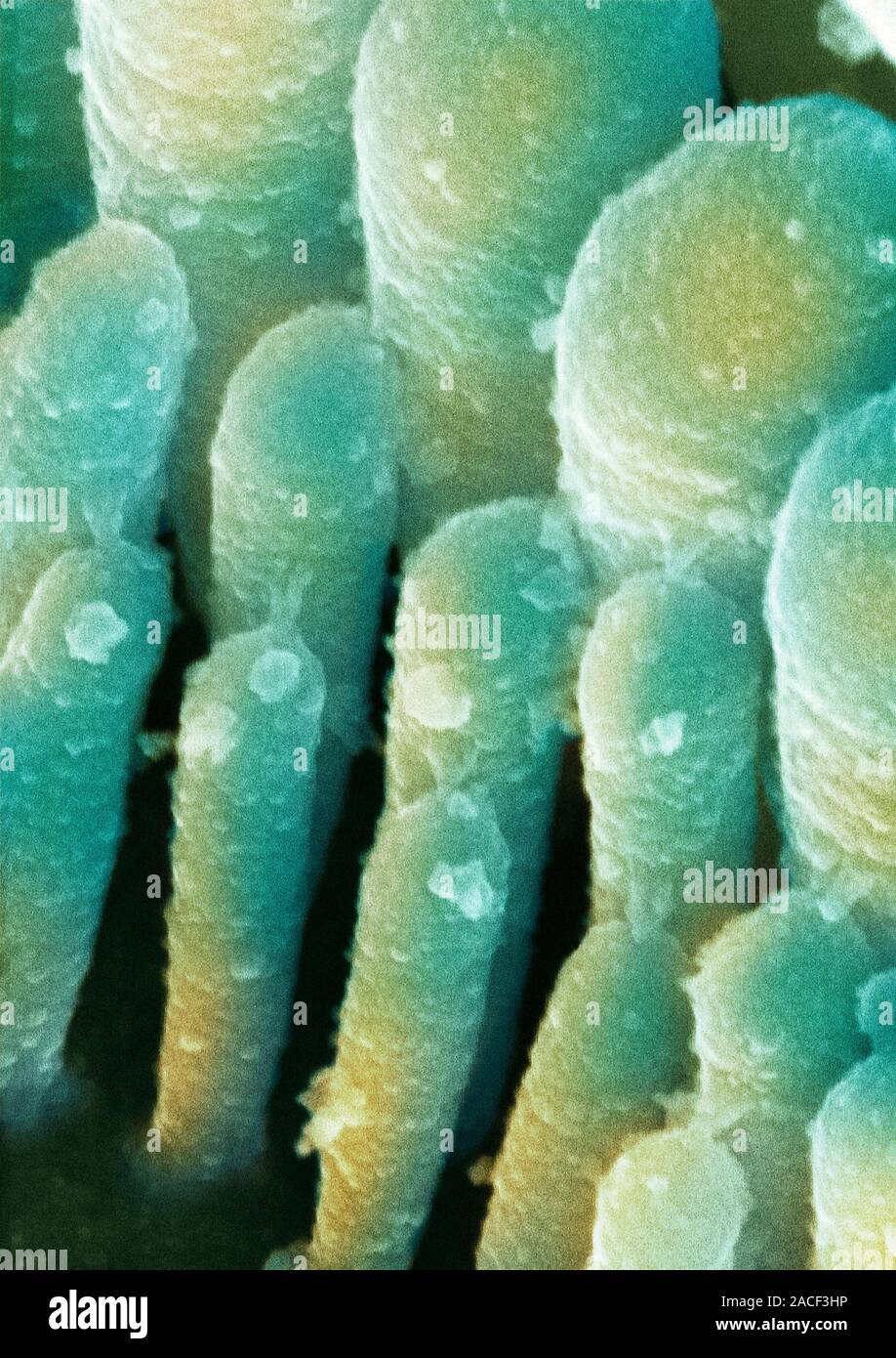 Inner ear hairs. Coloured scanning electron micrograph (SEM) of ...
