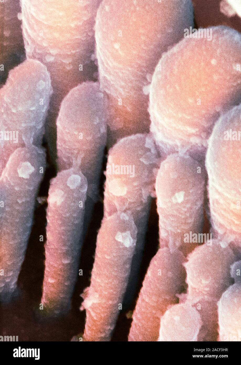Inner ear hairs. Coloured scanning electron micrograph (SEM) of ...