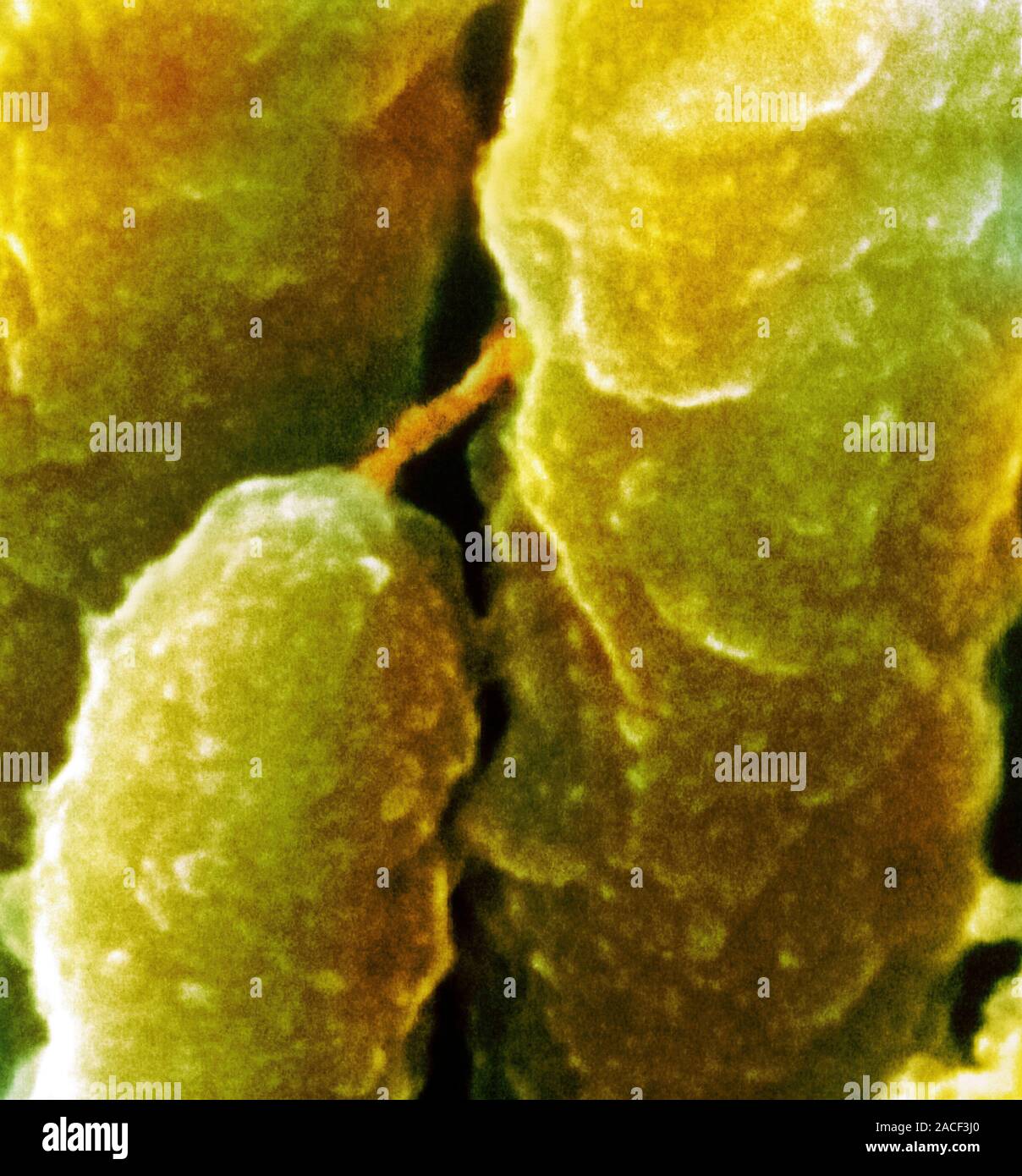 Inner ear hairs. Coloured scanning electron micrograph (SEM) of ...