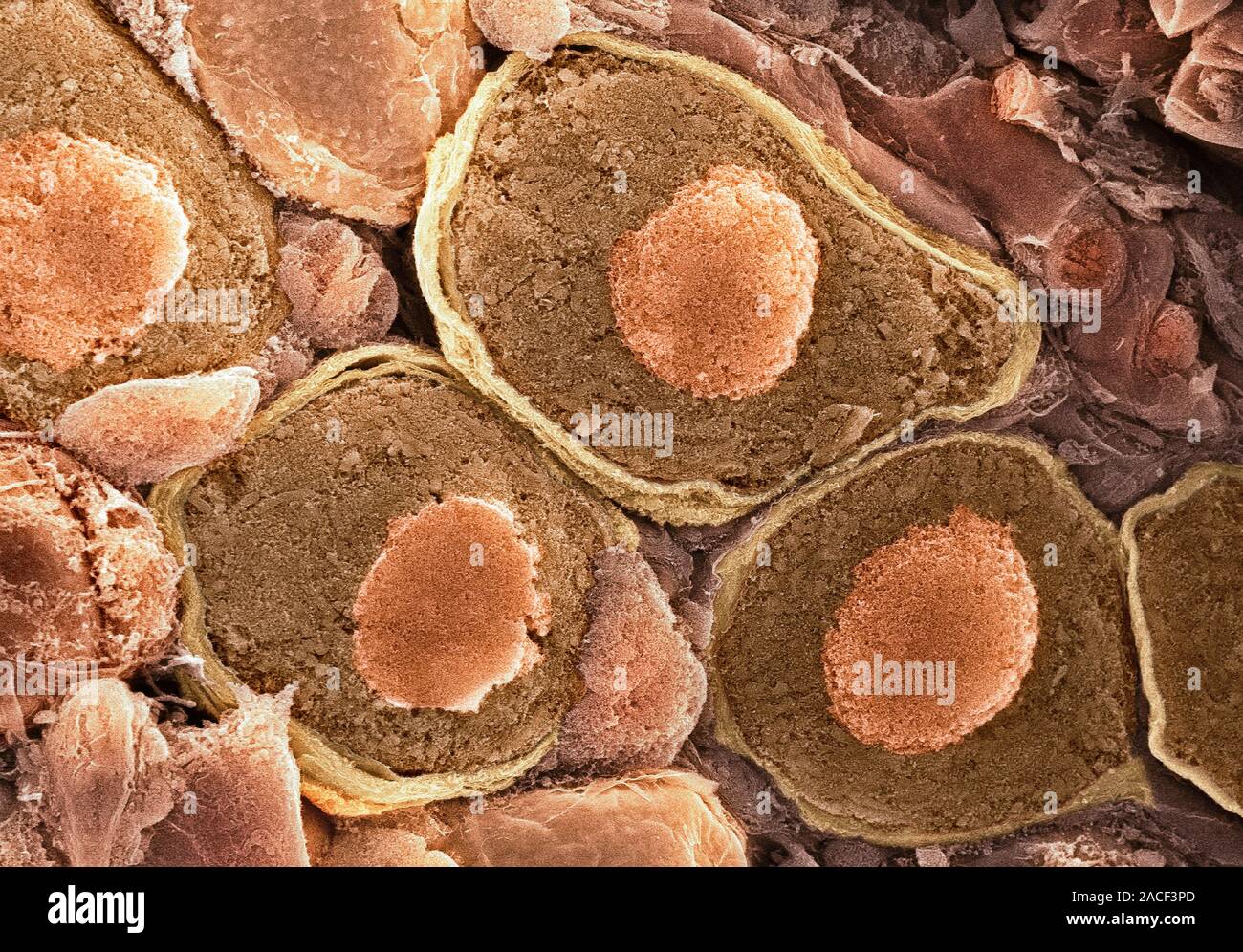 Nerve cells. Coloured scanning electron micrograph (SEM) of a section ...