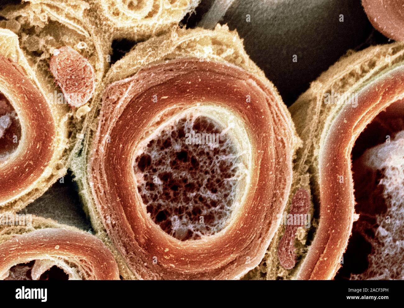 Myelinated nerves. Coloured scanning electron micrograph (SEM) of a ...