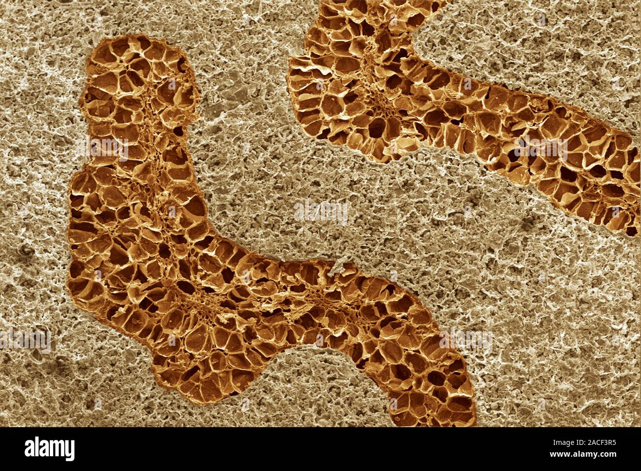 Nutmeg. Coloured scanning electron micrograph (SEM) of a transverse ...