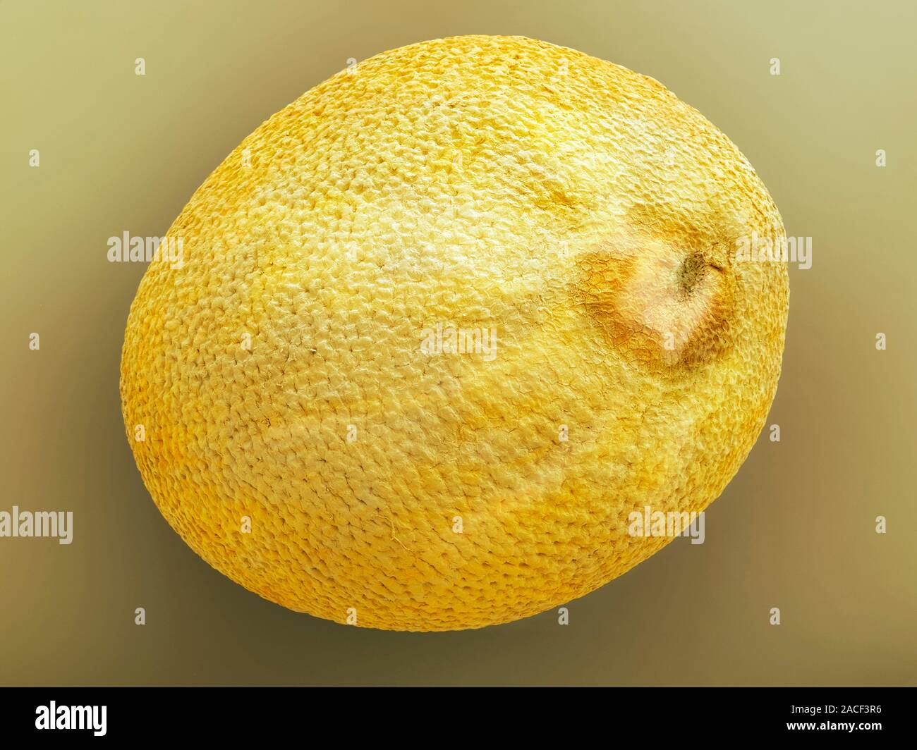 Yellow mustard seed, coloured scanning electron micrograph (SEM). This ...