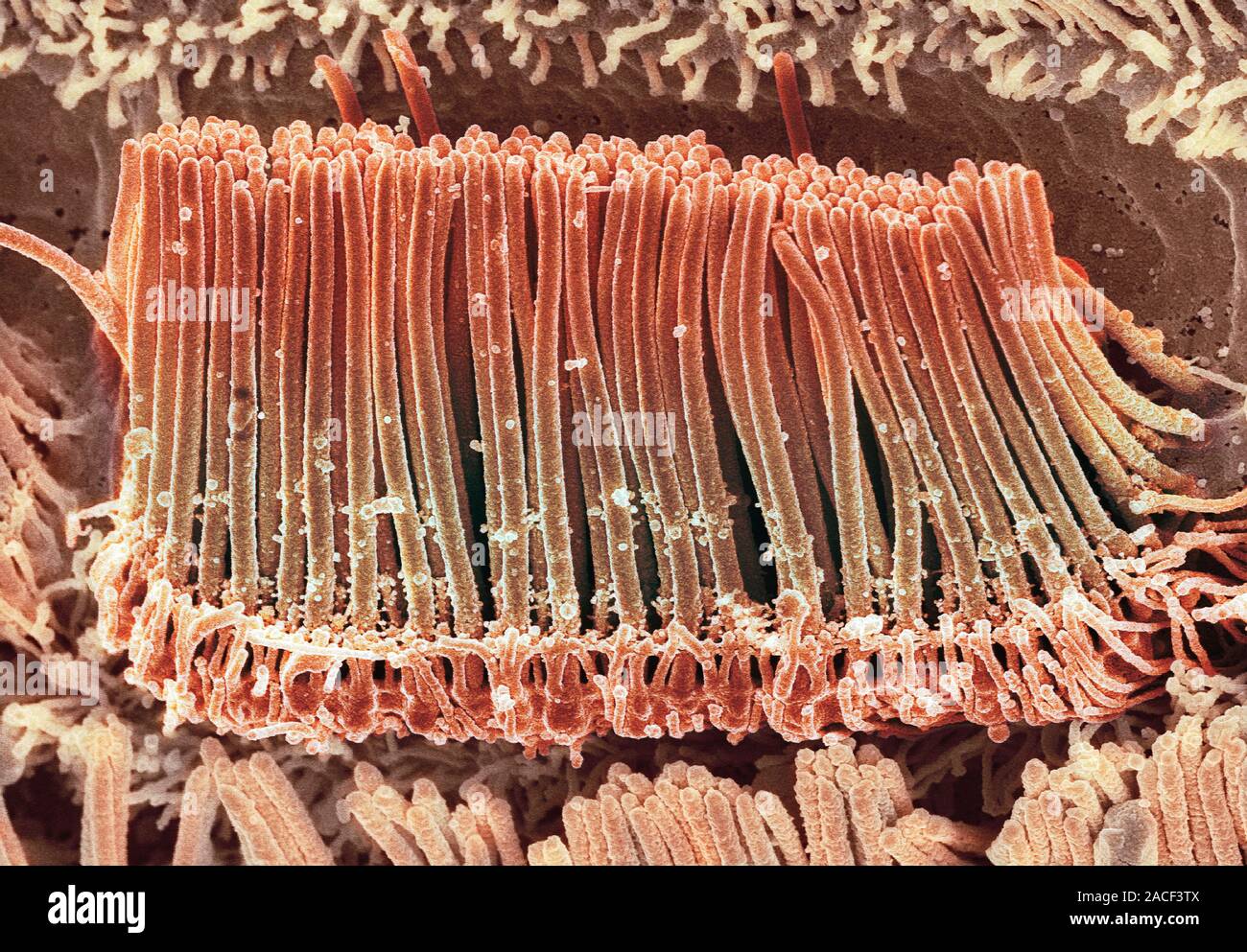 Squid sensory hair cells, coloured scanning electron micrograph (SEM ...