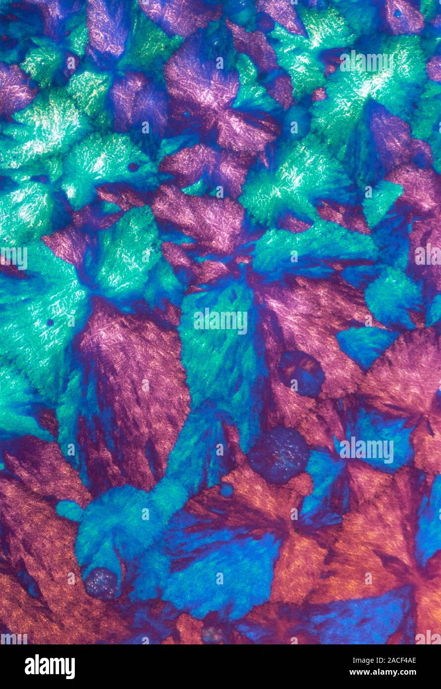 Immunoglobulin crystals, polarised light micrograph. Immunoglobulins ...