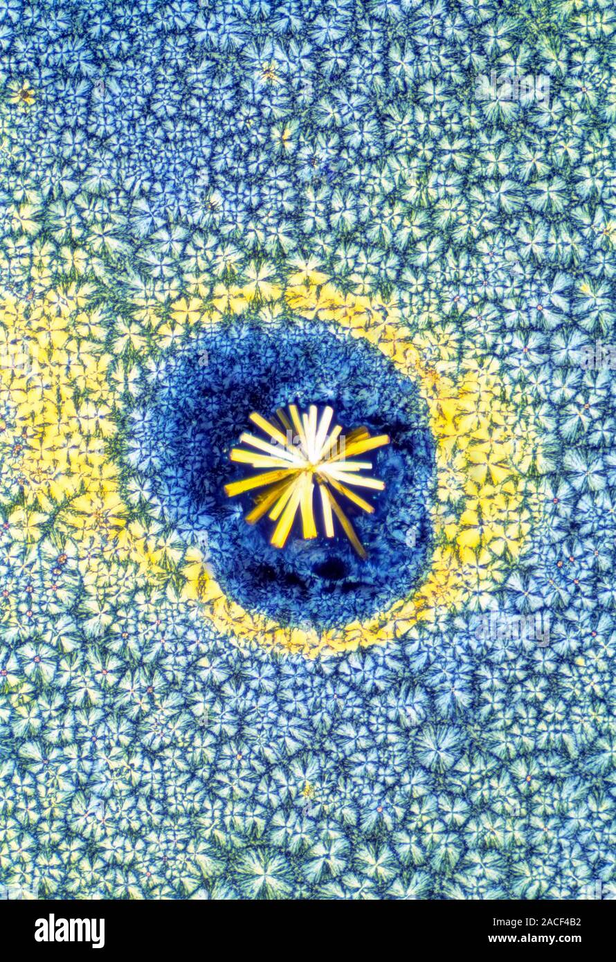 Retinoic acid crystal, polarised light micrograph. Retinoic acid is one ...