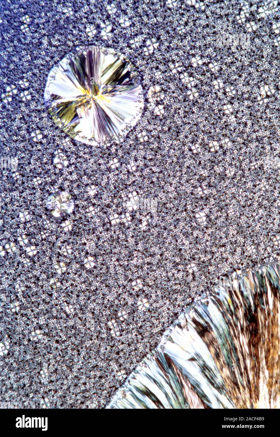 Vitamin B1 crystals, polarised light micrograph. Vitamin B1, also ...