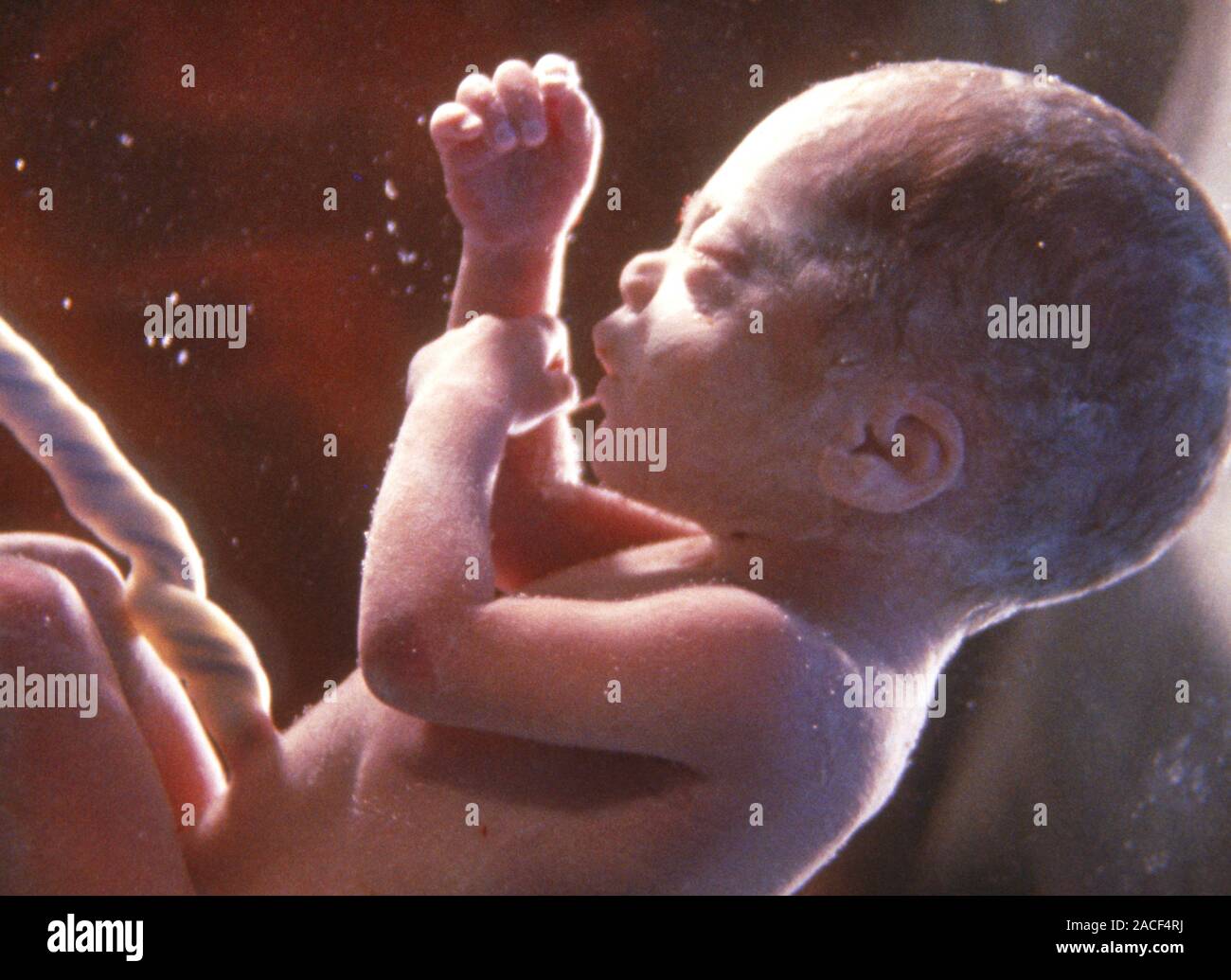 Full term foetus in its mothers uterus (womb). The foetus develops in ...