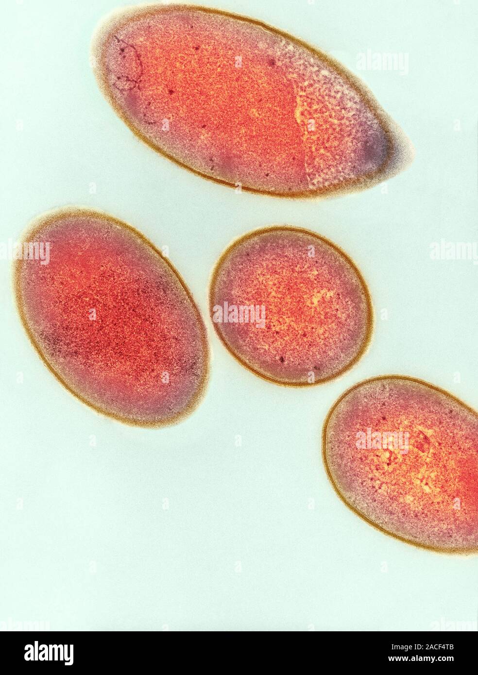 Clostridium difficile bacteria, coloured transmission electron ...