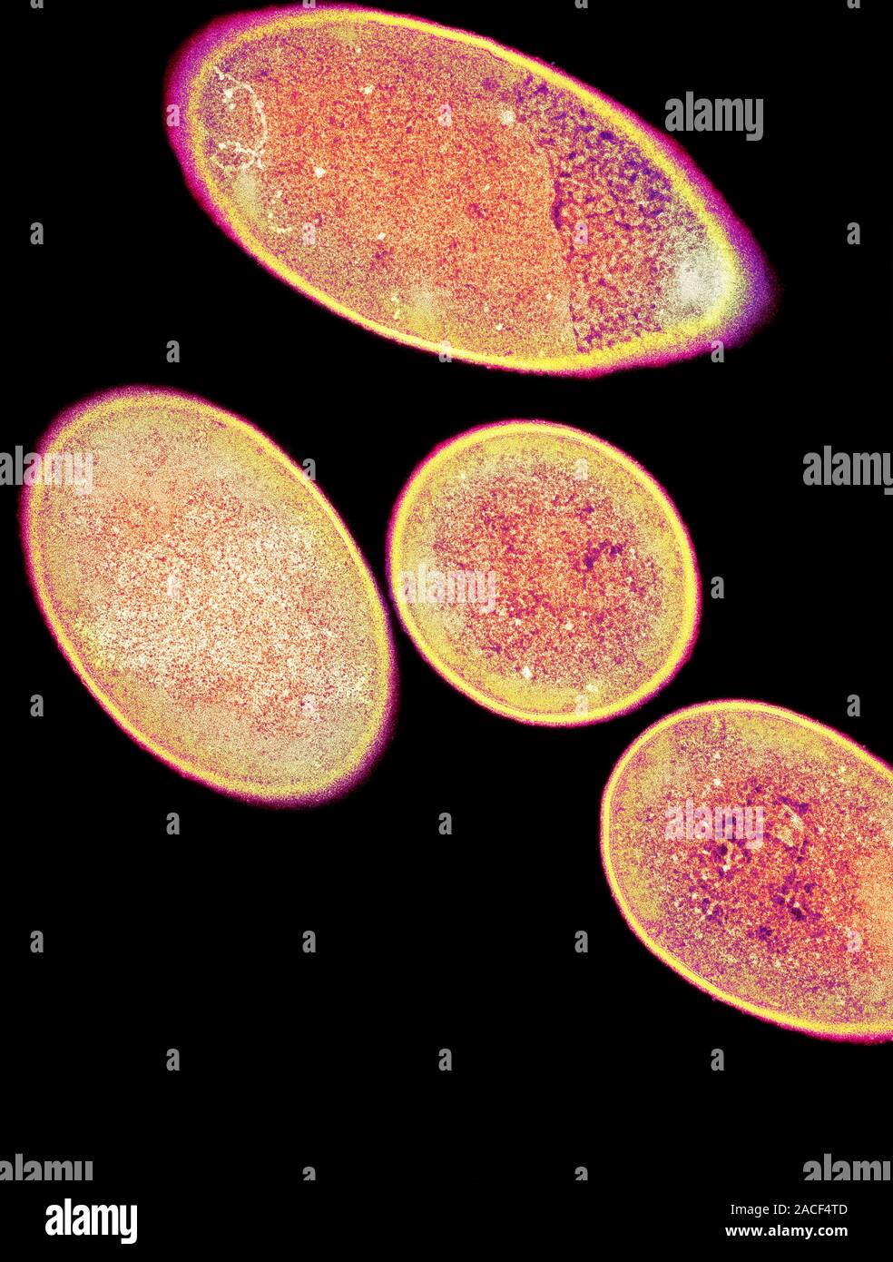 Clostridium Difficile Bacteria Coloured Transmission Electron Micrograph Tem These Gram