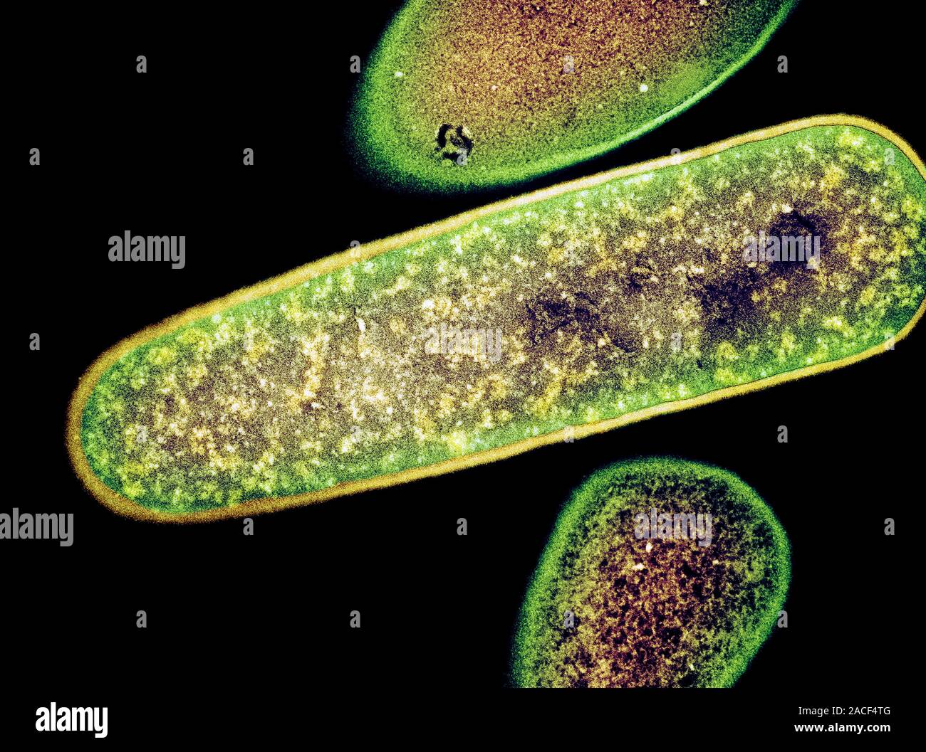 Clostridium difficile bacteria, coloured transmission electron ...