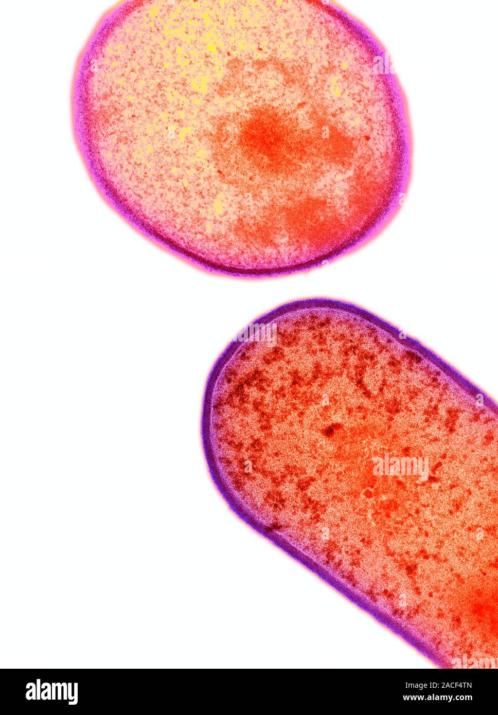 Clostridium difficile bacteria, coloured transmission electron ...