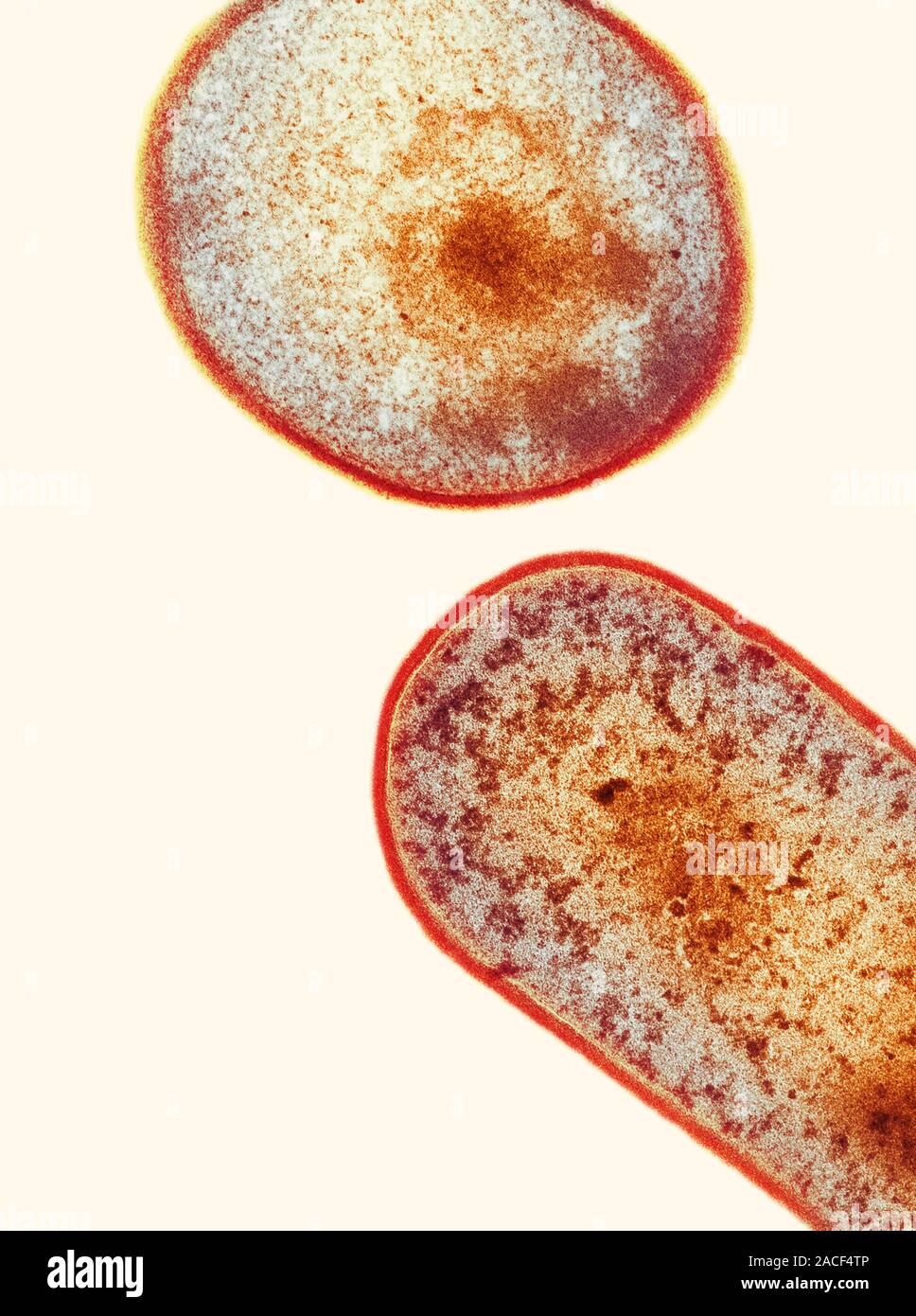 Clostridium difficile bacteria, coloured transmission electron ...