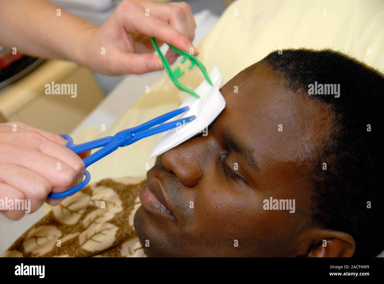 Changing a facial dressing. Hospital nurse changing a patient's facial ...