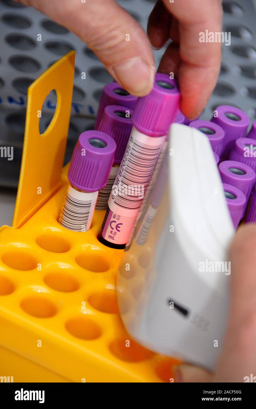 Barcode scanning of donated blood. Haematologist scanning vacutainer ...