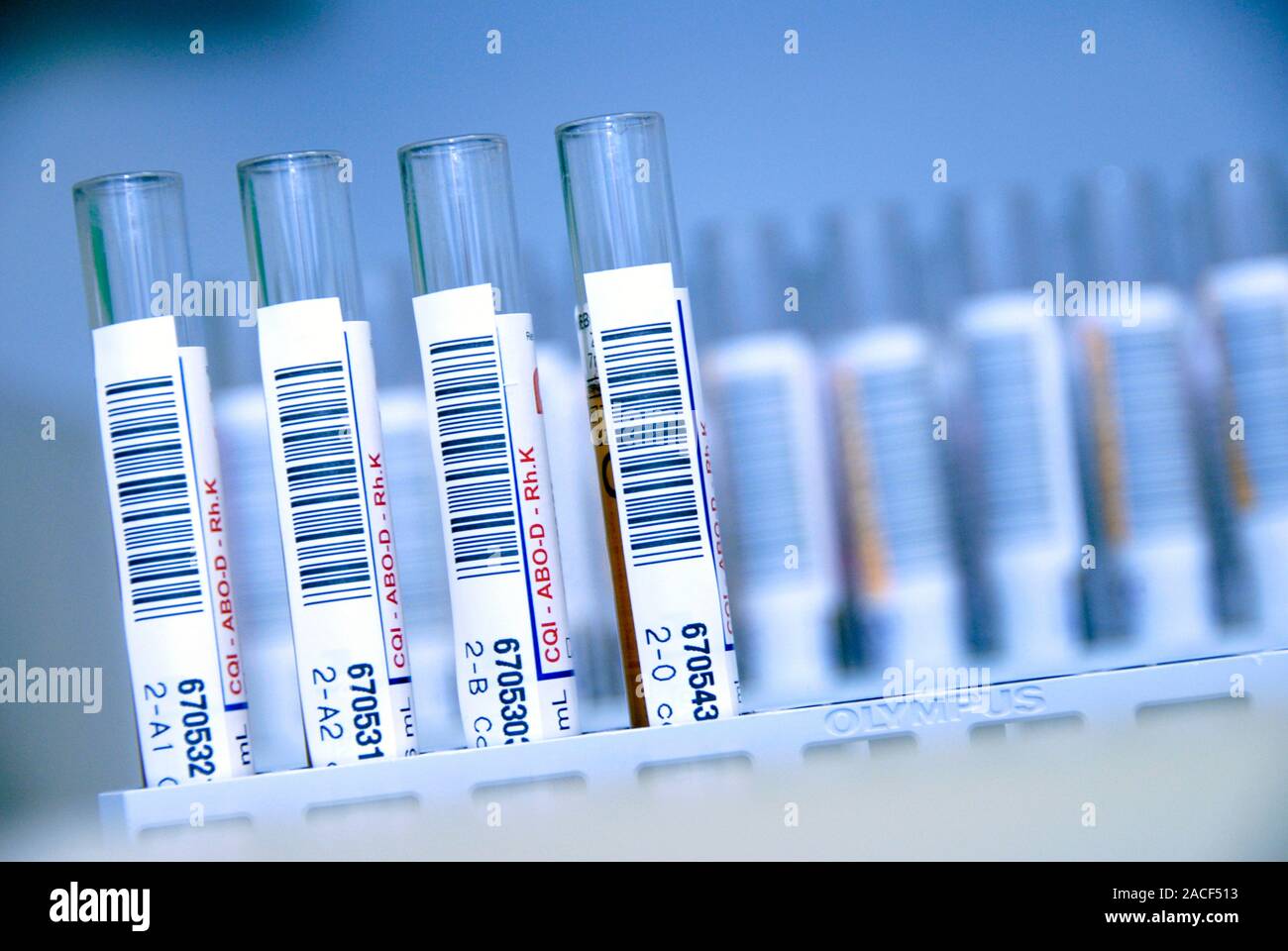 Blood samples awaiting screening in a haematology laboratory. The ...