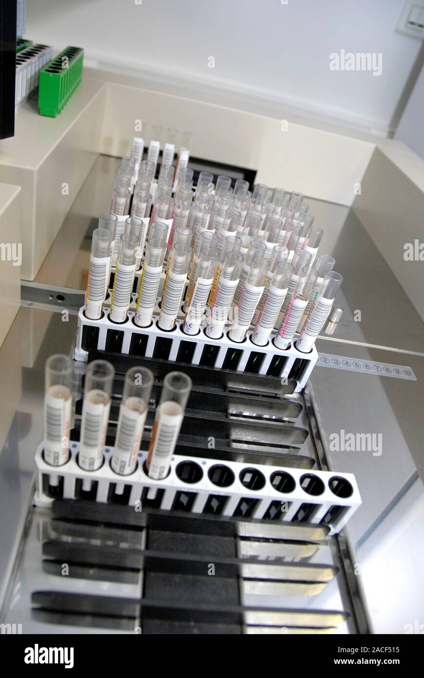 Blood analysis. Samples of donated blood being analysed by a blood ...