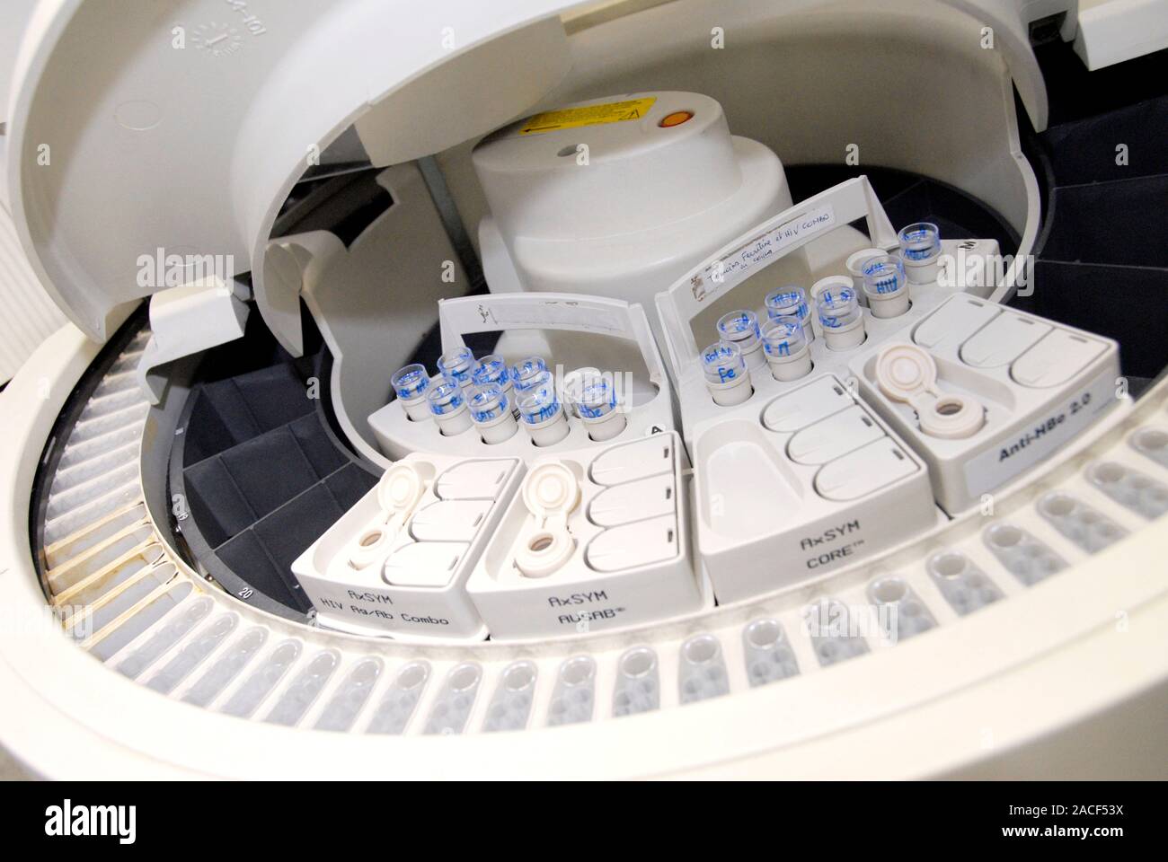 Blood analyser in a haematology laboratory. This blood analysing ...