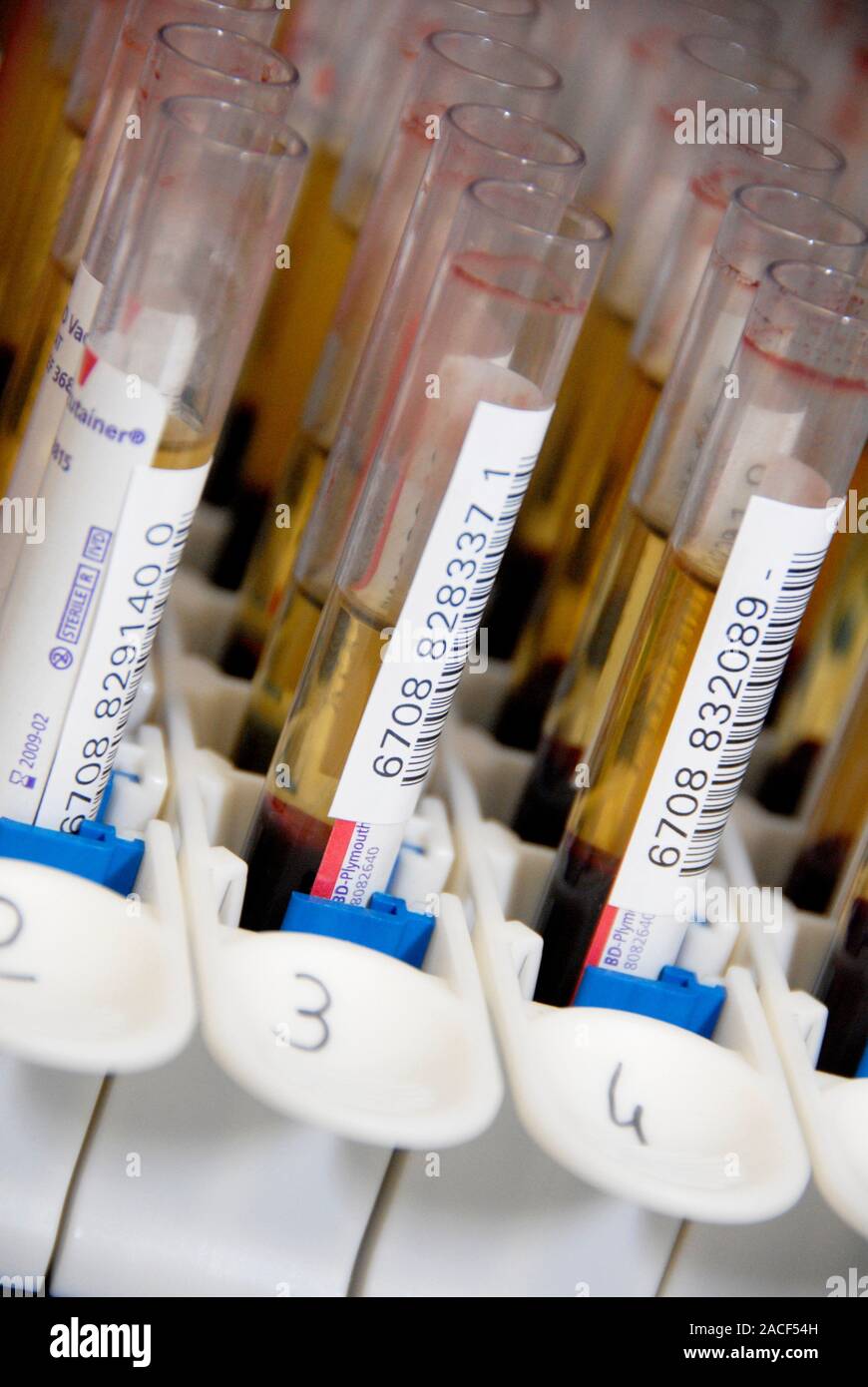Blood samples awaiting screening in a haematology laboratory. The ...