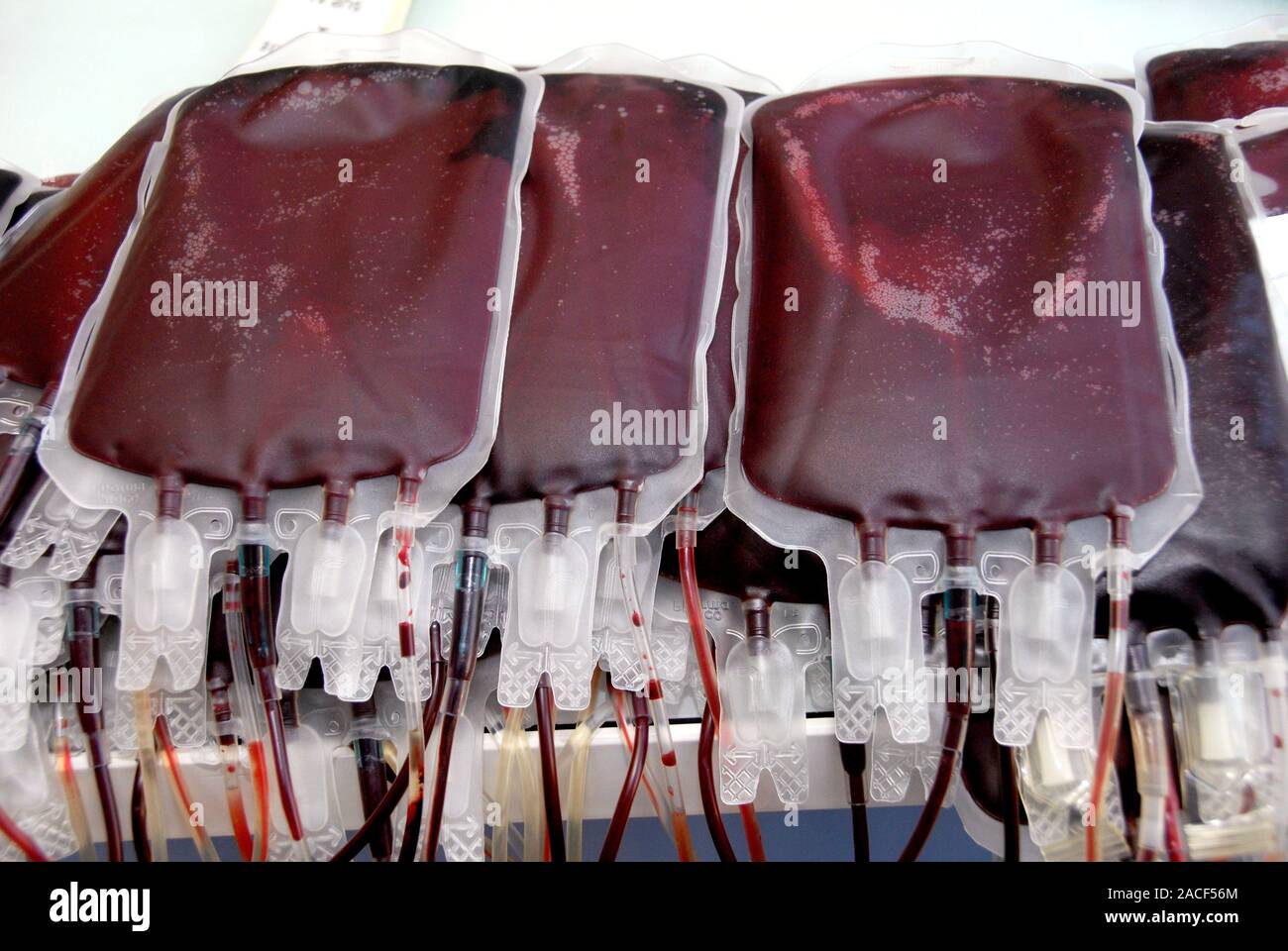 Bags of separated red blood cells (erythrocytes). These red blood cells ...