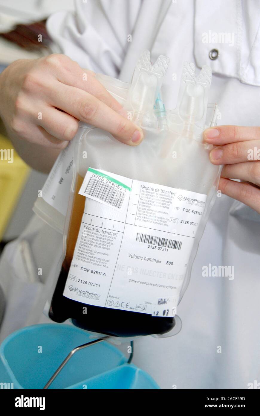 Donor blood processing. Haematologist holding a blood bag containing ...