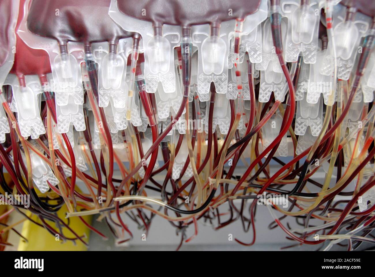 Donor blood processing. The donor blood in these blood bags is being ...