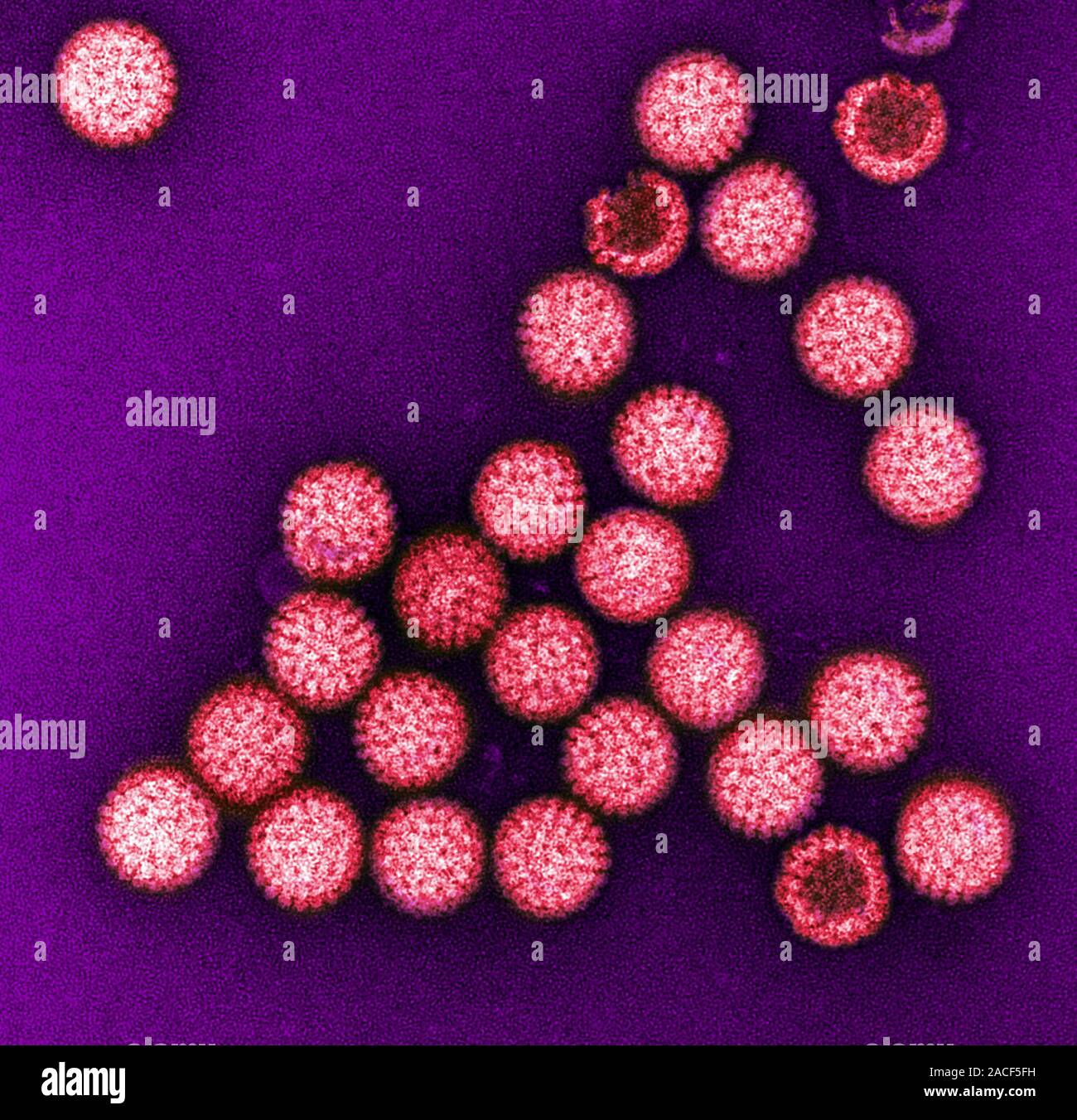 Rotavirus particles. Coloured transmission electron micrograph (TEM) of ...