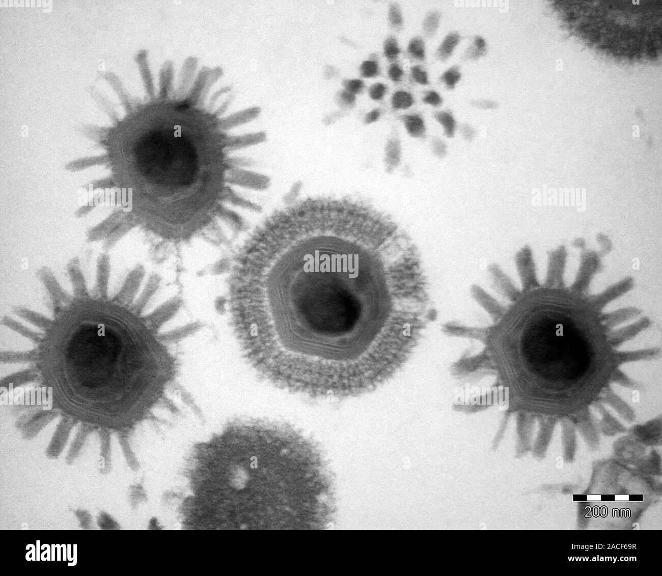 Mimivirus. Transmission electron micrograph (TEM) of Acanthamoeba ...