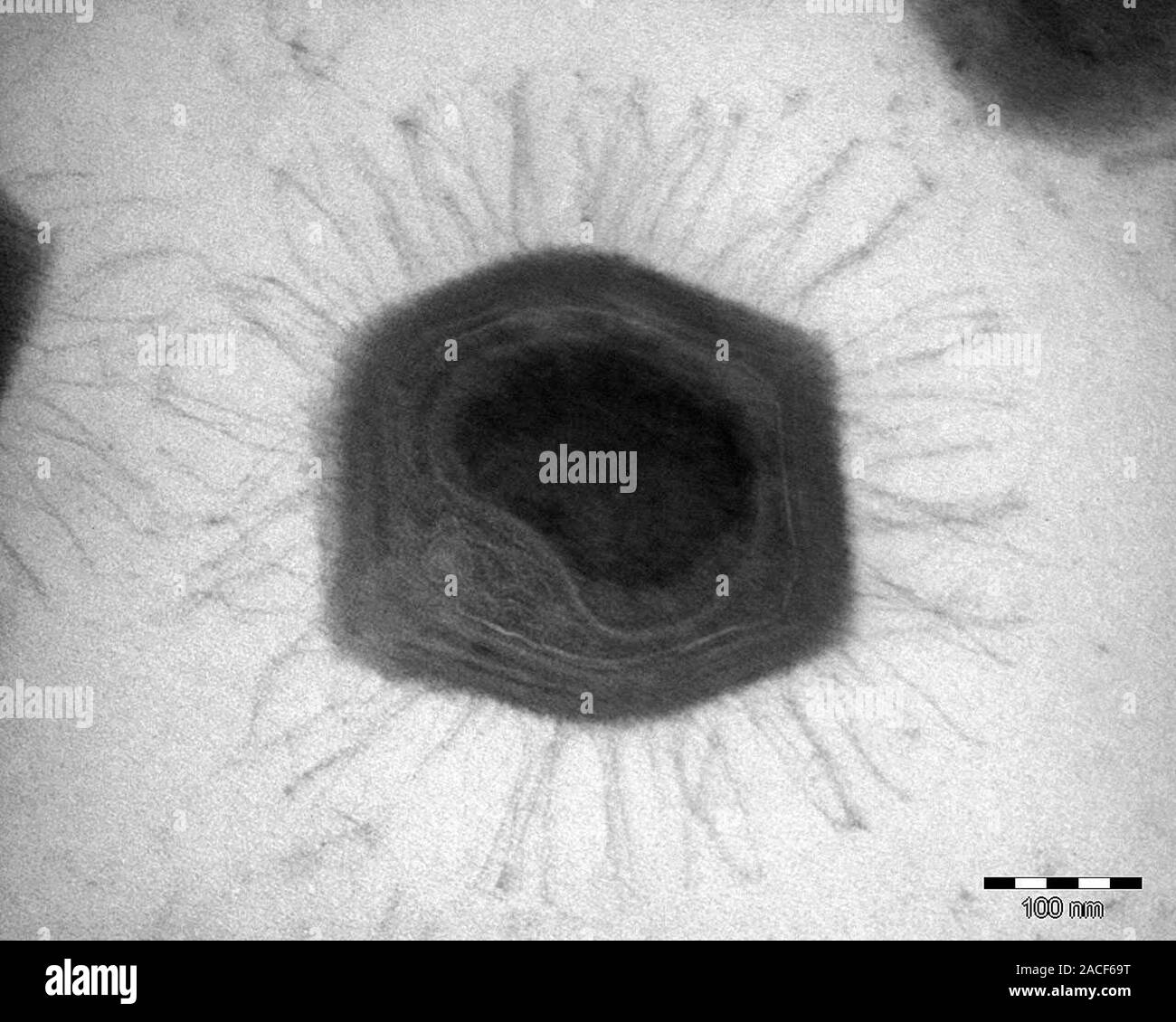 Mimivirus. Transmission electron micrograph (TEM) of an Acanthamoeba ...