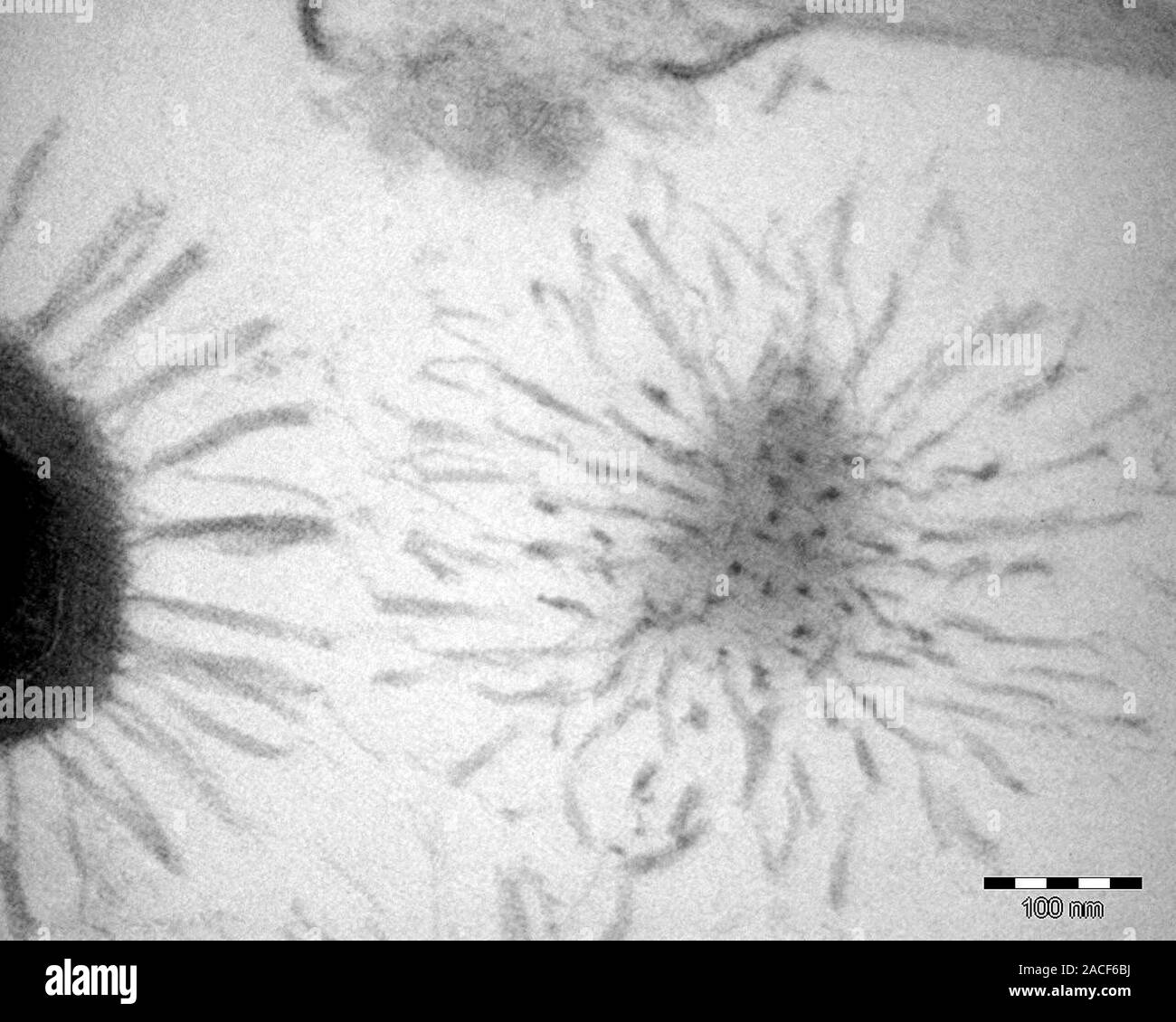 Mimivirus. Transmission electron micrograph (TEM) of Acanthamoeba ...