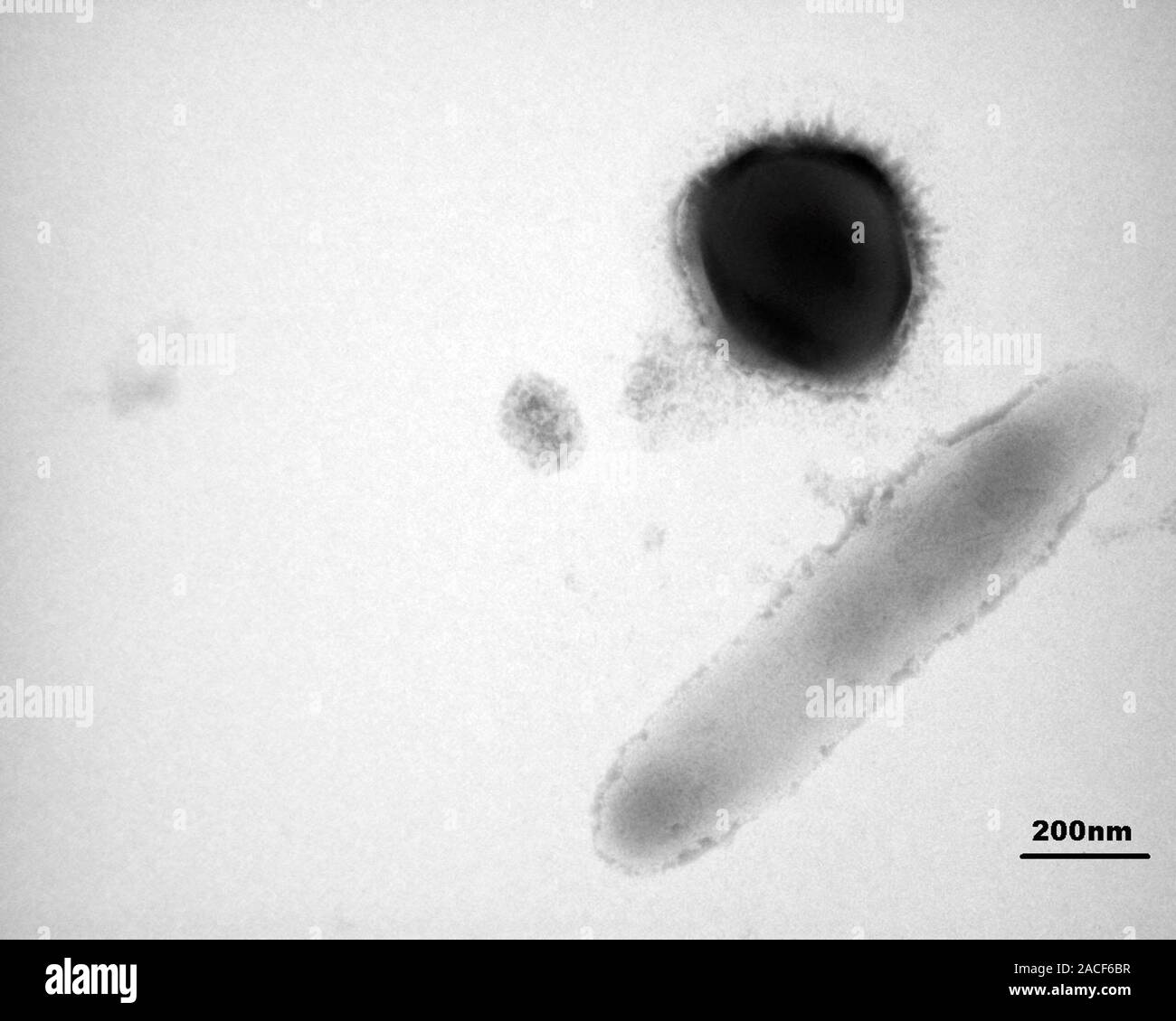 Mimivirus. Transmission electron micrograph (TEM) of an Acanthamoeba ...