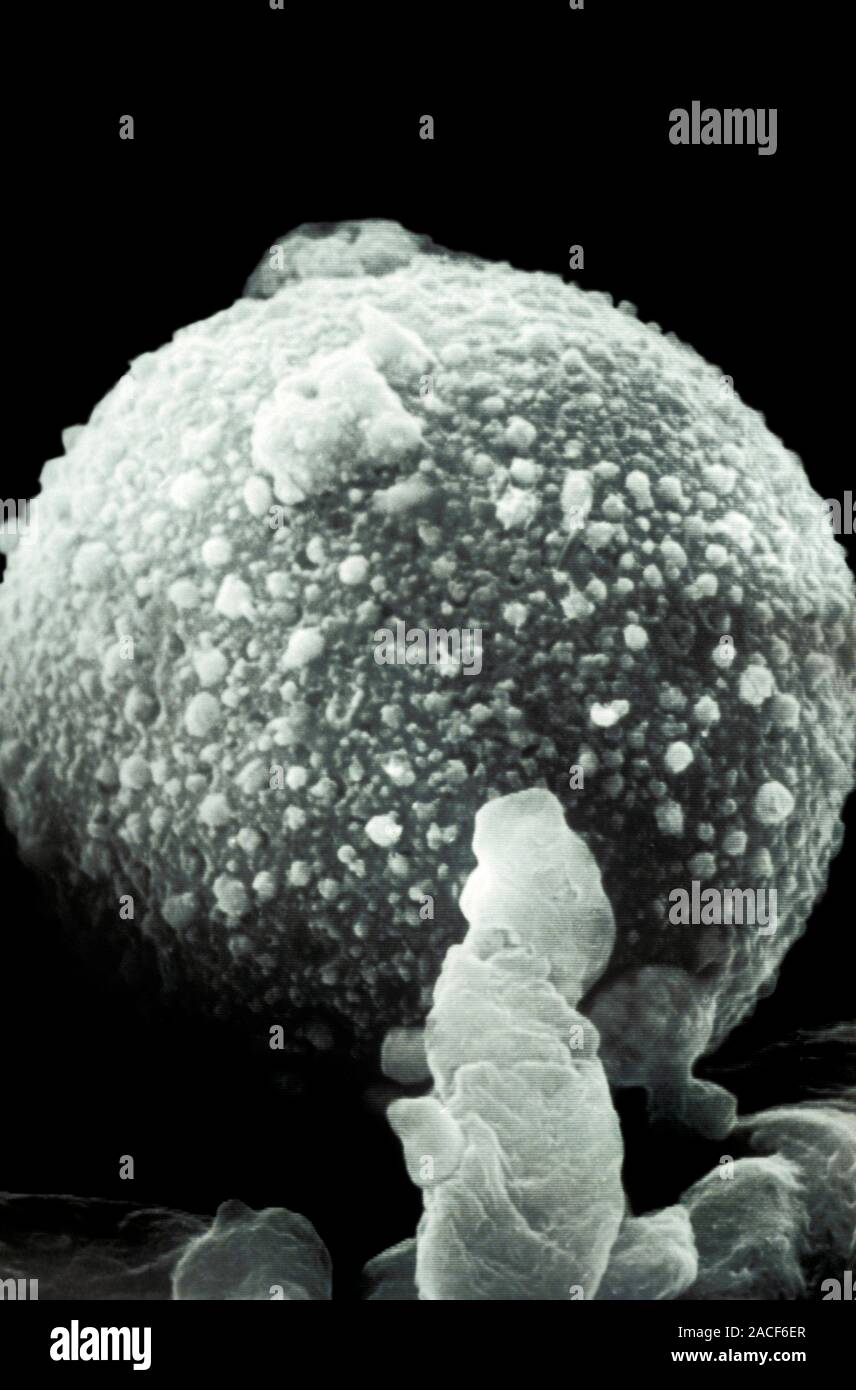 Forensic pollen evidence, scanning electron micrograph (SEM). Pollen ...