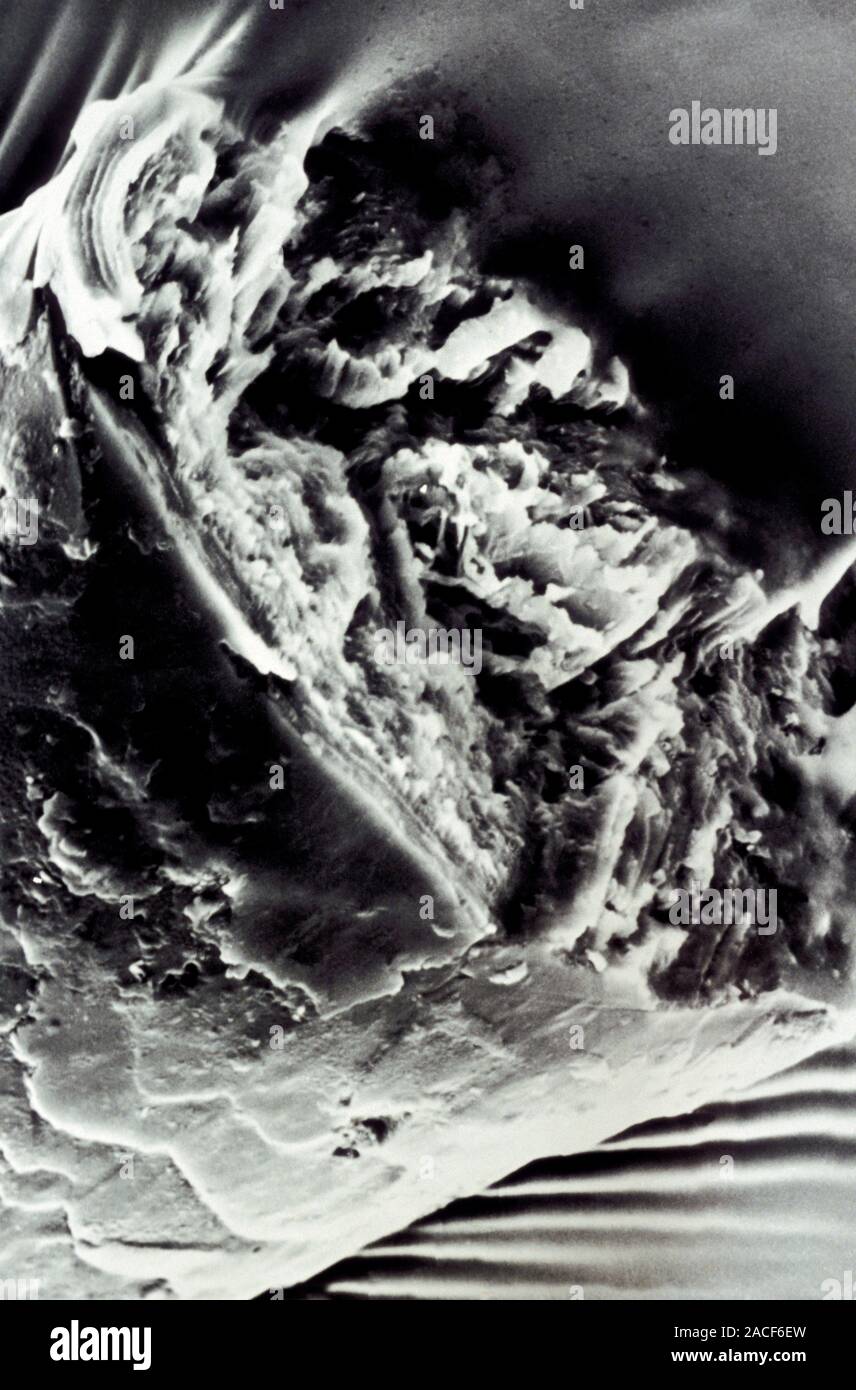 Forensic hair evidence, scanning electron micrograph (SEM). Close-up of ...