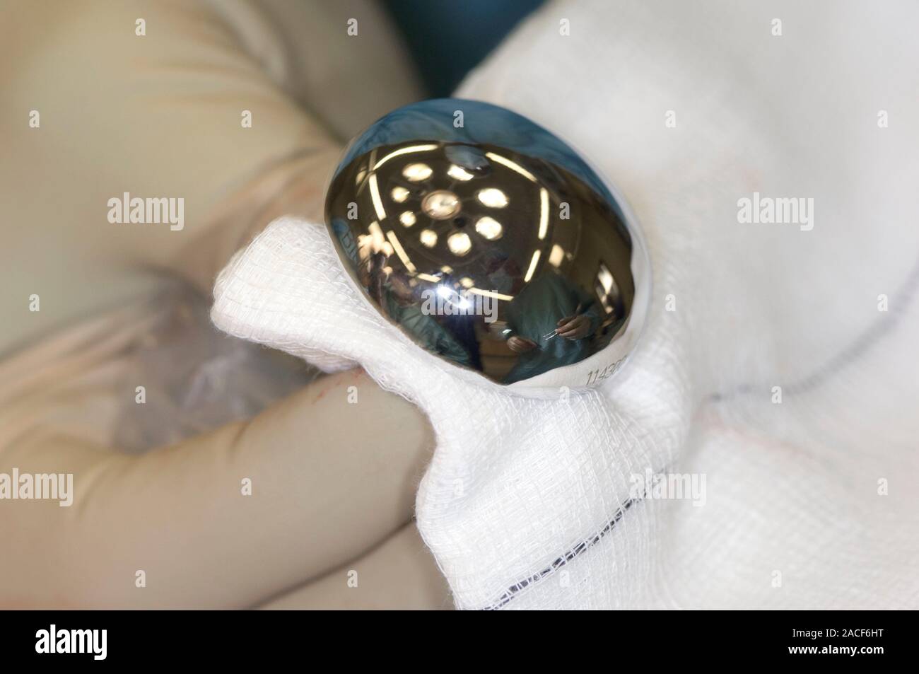 Shoulder joint re-surfacing surgery. Image 9 of 11. Close-up of the ...