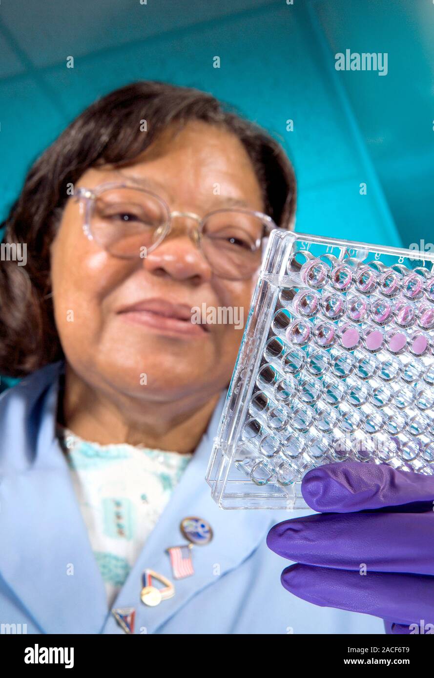 Medical dressing development. Technician observing a microtitre plate ...