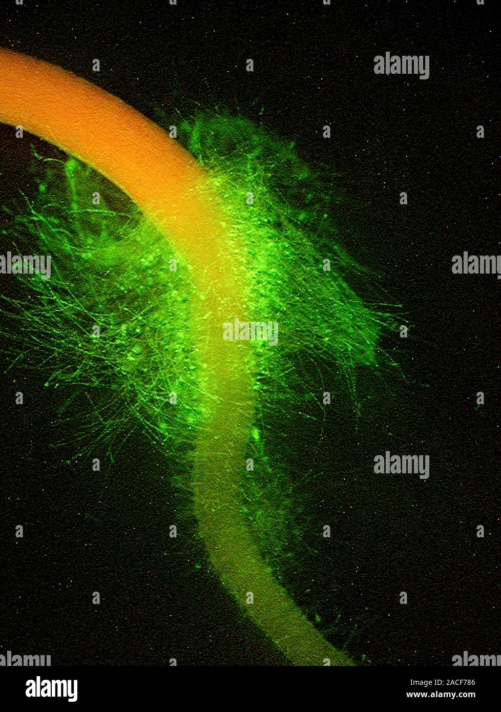 Listeria bacteria on broccoli root hairs. Fluorescent light micrograph ...
