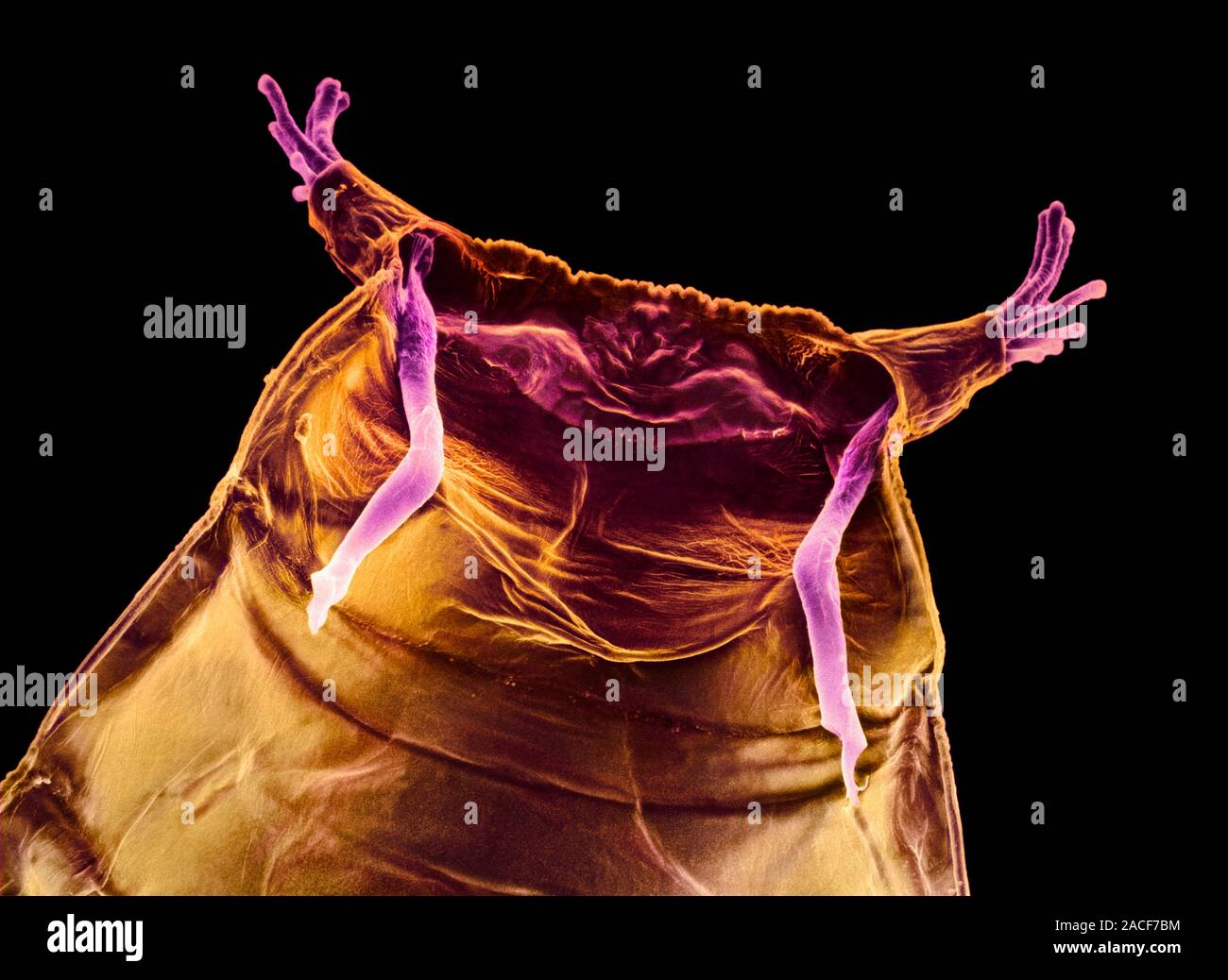 Fruit fly pupa case. Coloured scanning electron micrograph (SEM) of the ...