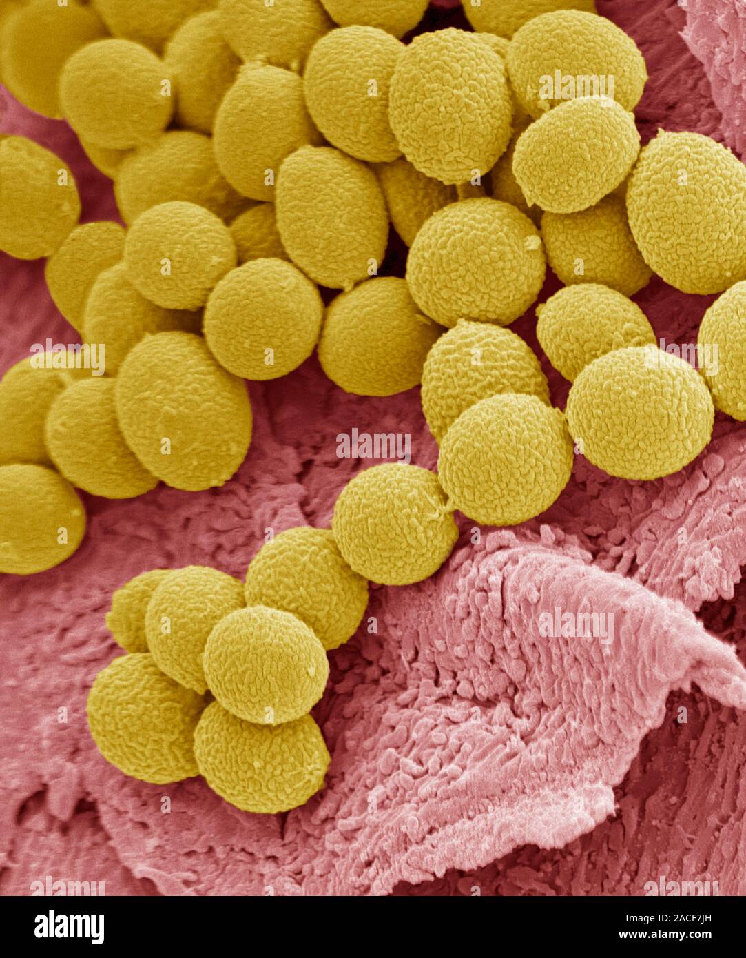 Athlete's foot. Coloured scanning electron micrograph (SEM) of spores ...