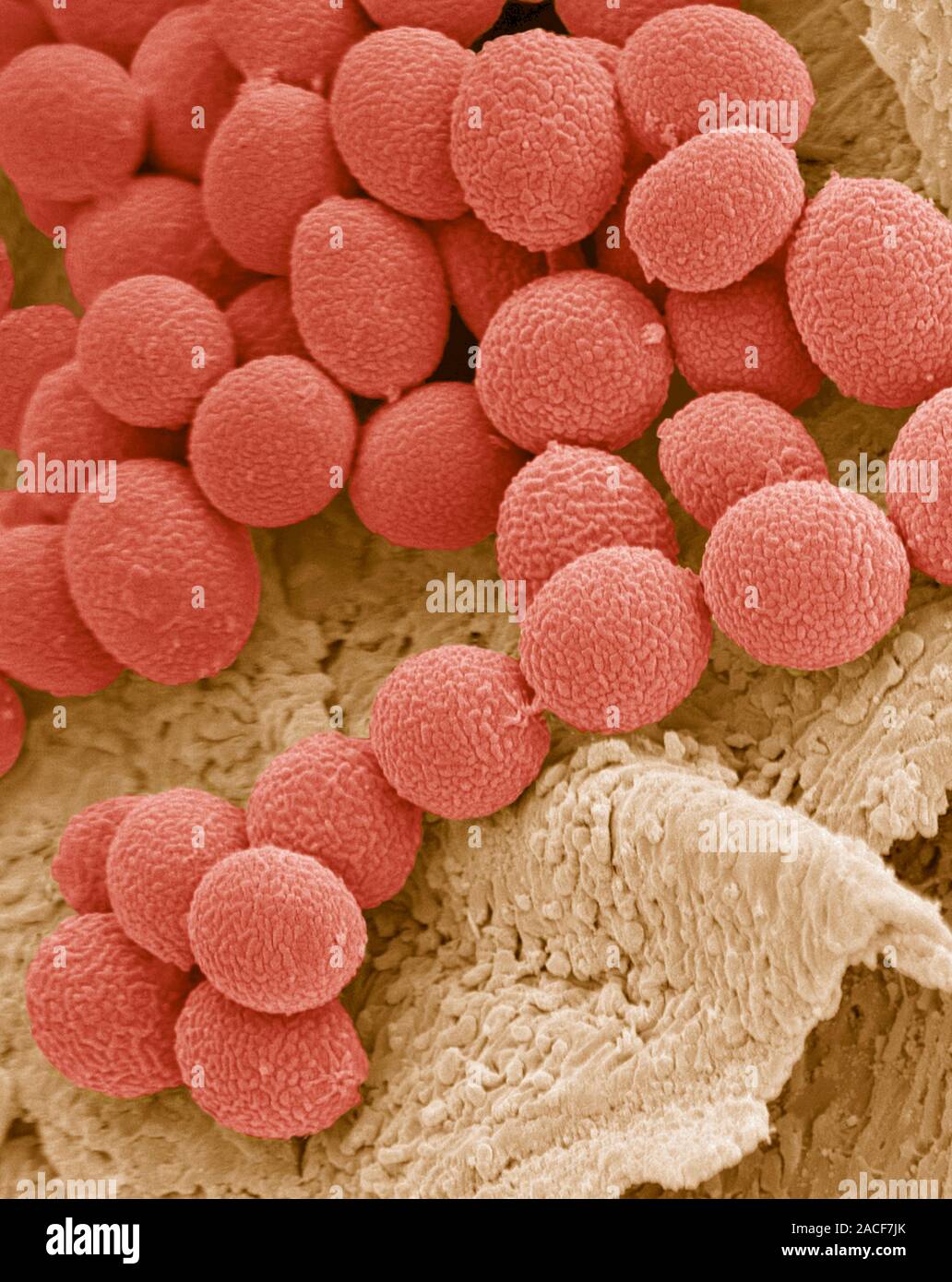 Athlete's foot. Coloured scanning electron micrograph (SEM) of spores ...