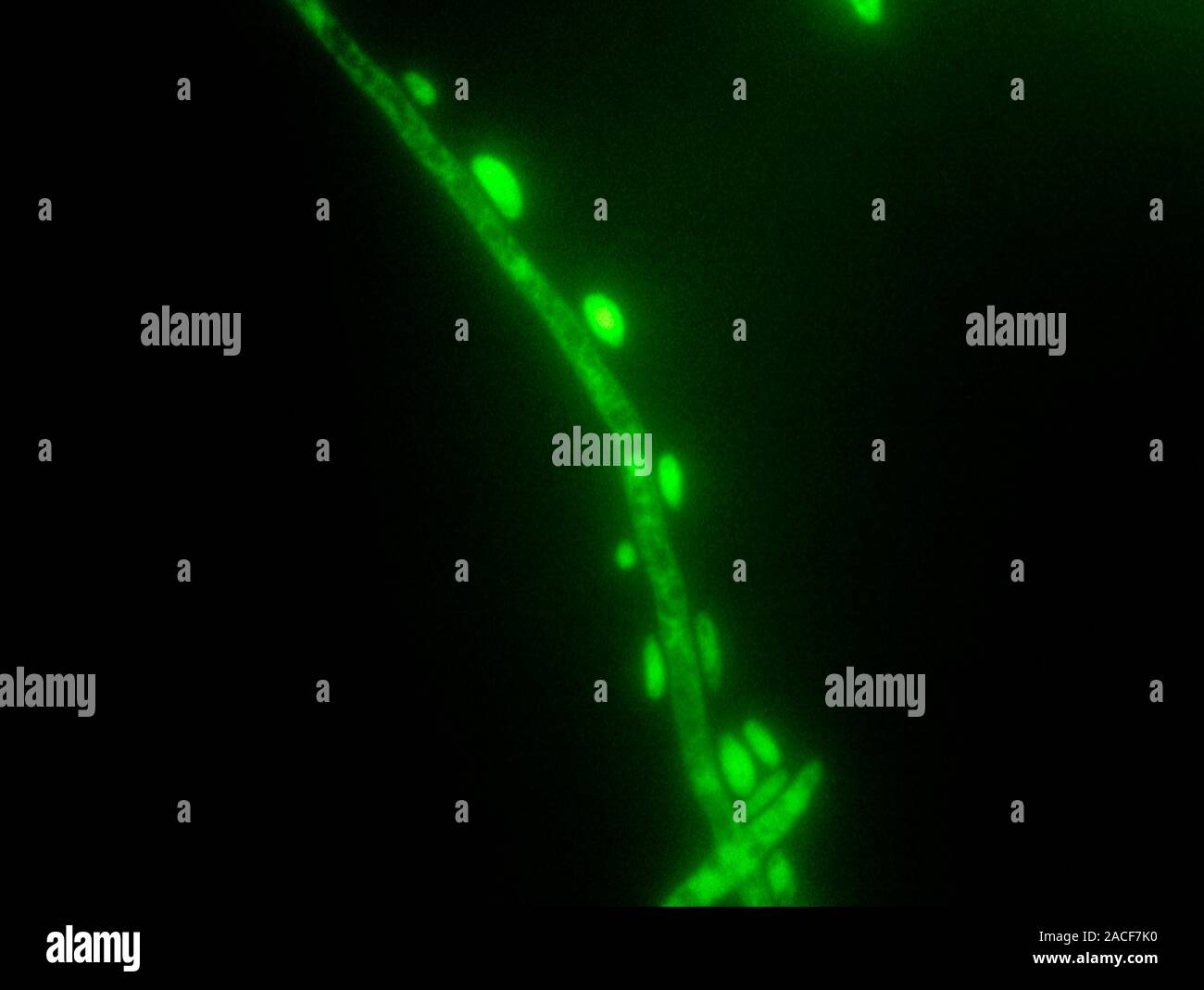 Antifungal agent research. Fluorescent light micrograph showing a ...