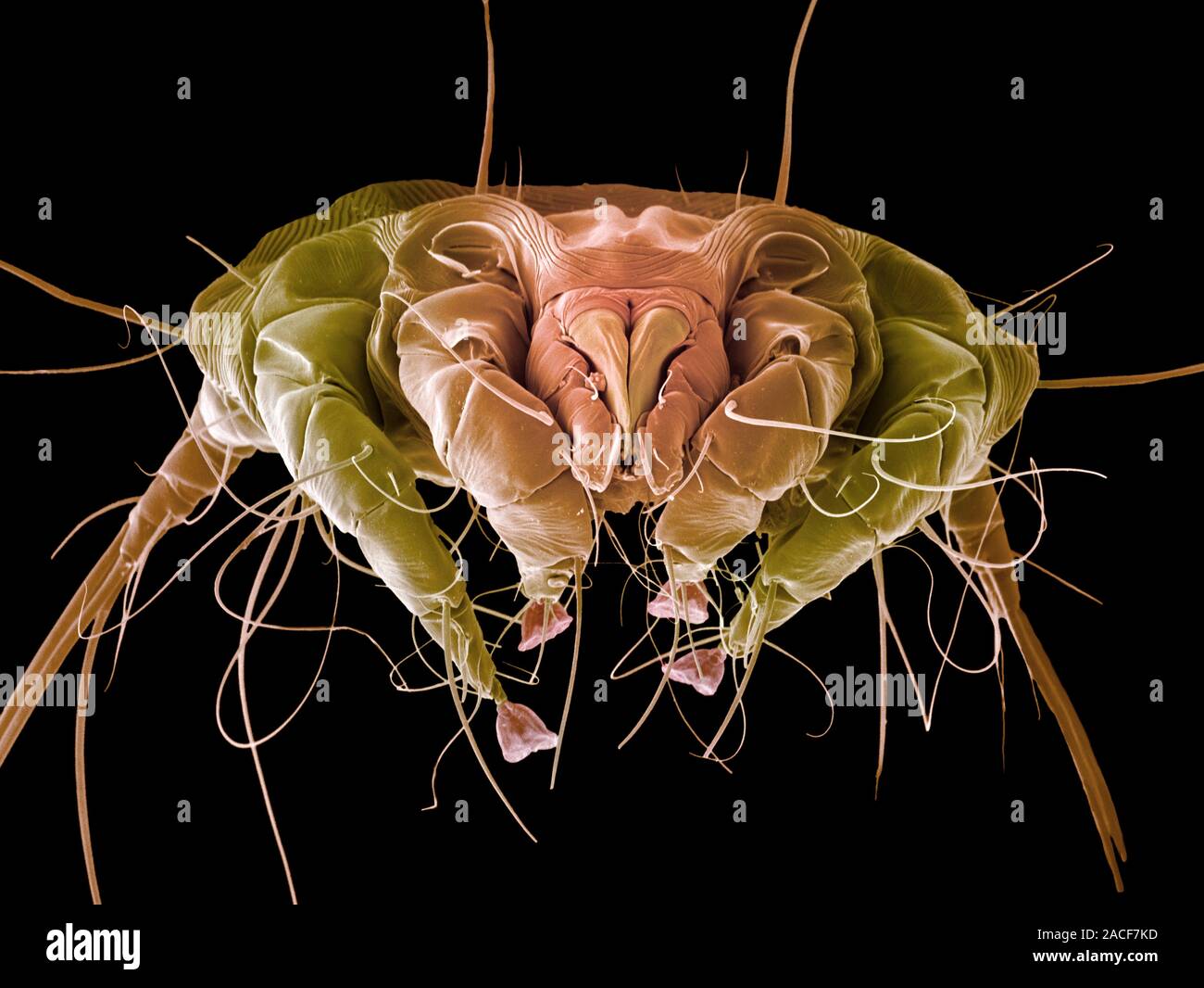 Hedgehog mite (Caparinia sp.), coloured scanning electron micrograph ...