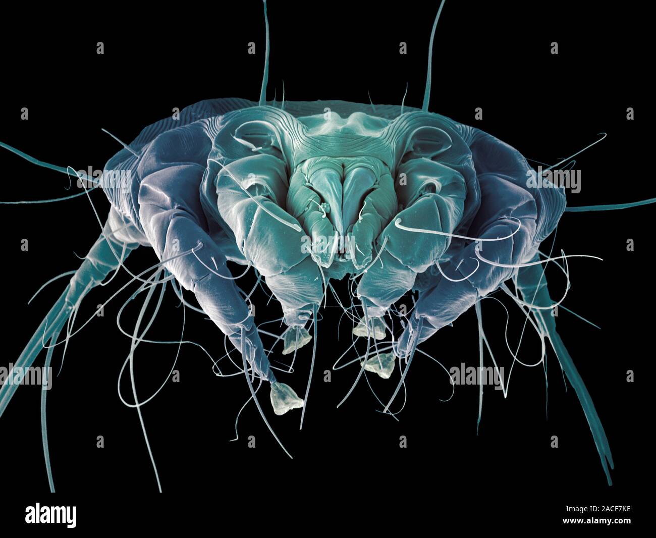 Hedgehog mite (Caparinia sp.), coloured scanning electron micrograph ...