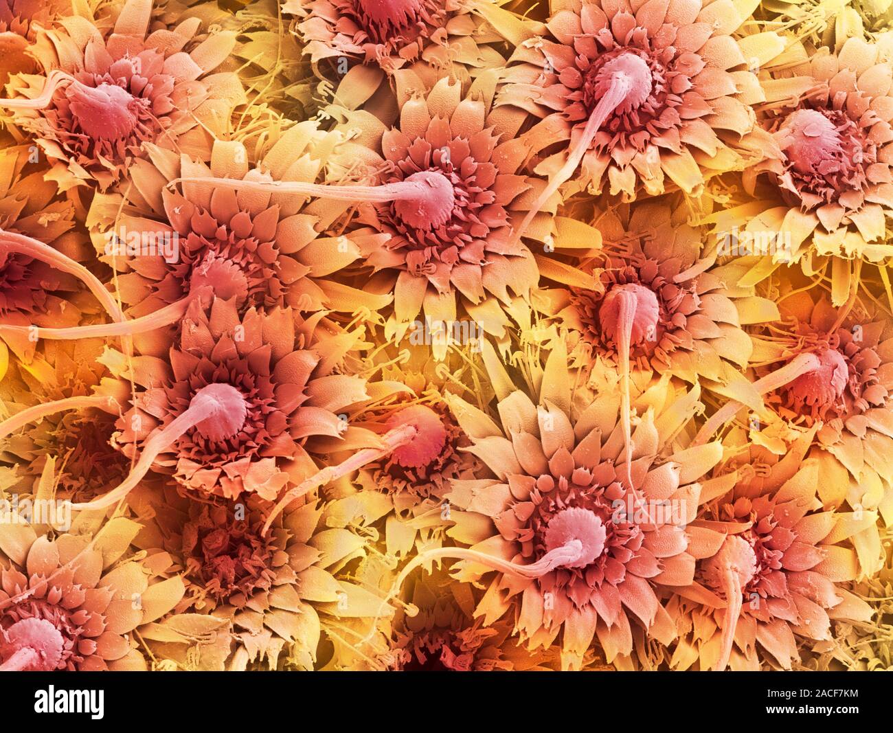 Chicken body louse eggs. Coloured scanning electron micrograph (SEM) of ...