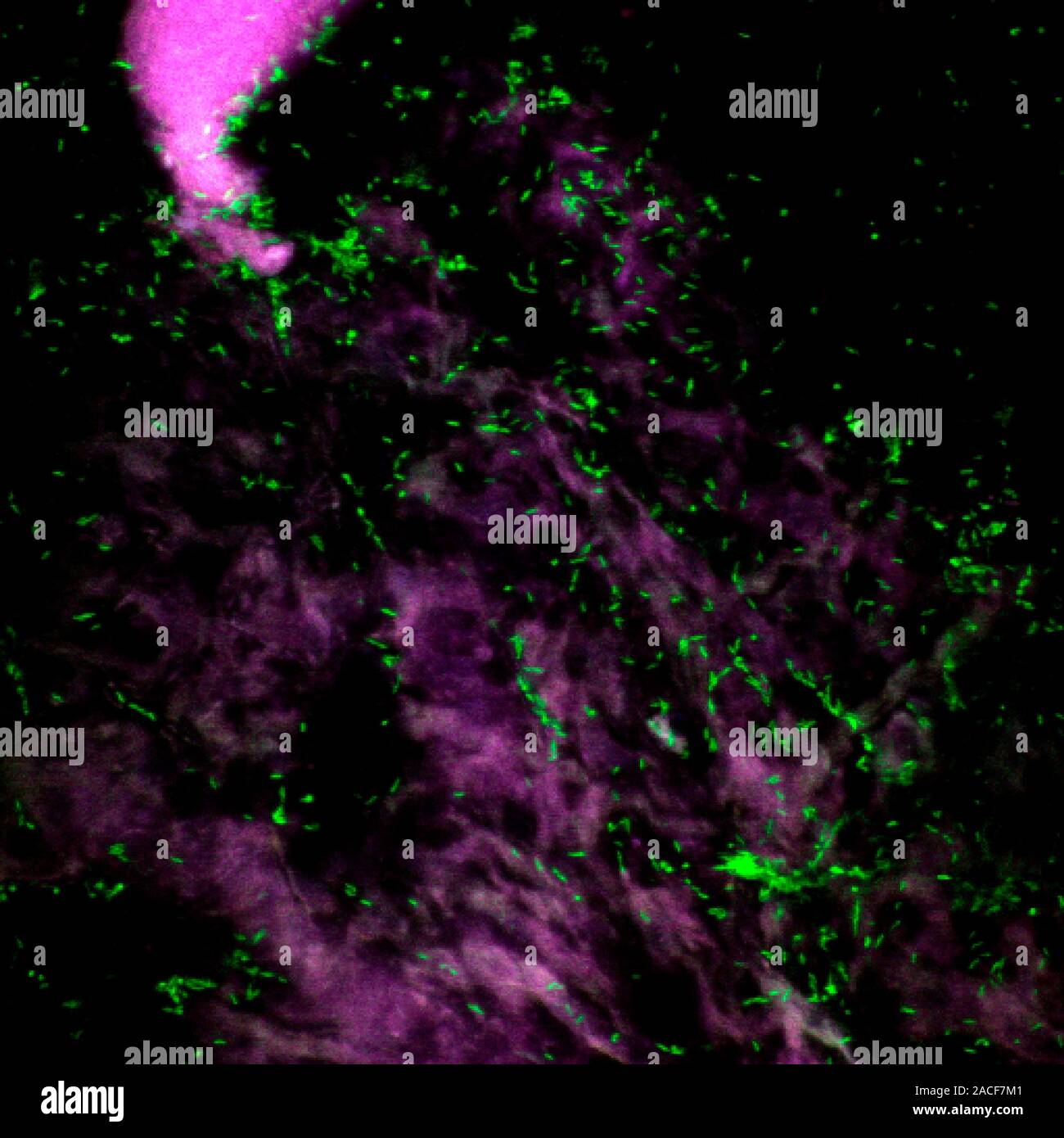 Campylobacter bacteria on chicken skin. Confocal light micrograph of ...