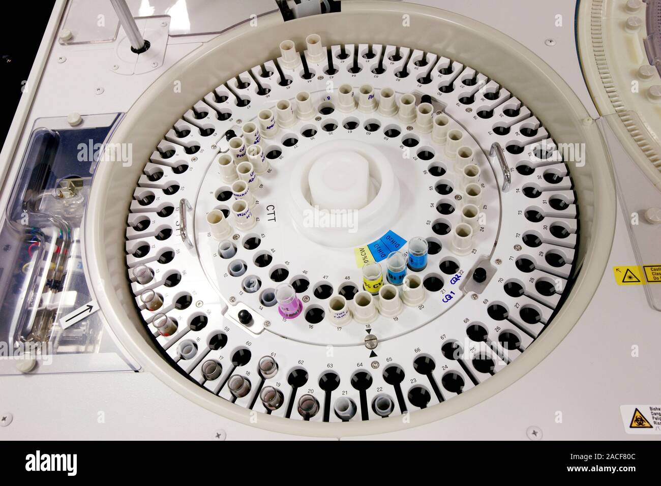 Blood centrifuge. A centrifuge is a machine that spins its contents ...