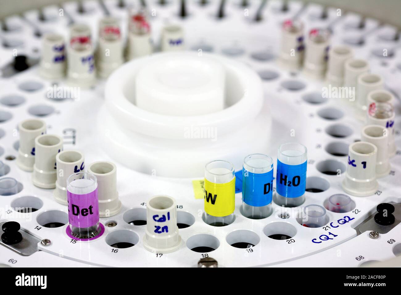 Blood centrifuge. A centrifuge is a machine that spins its contents ...