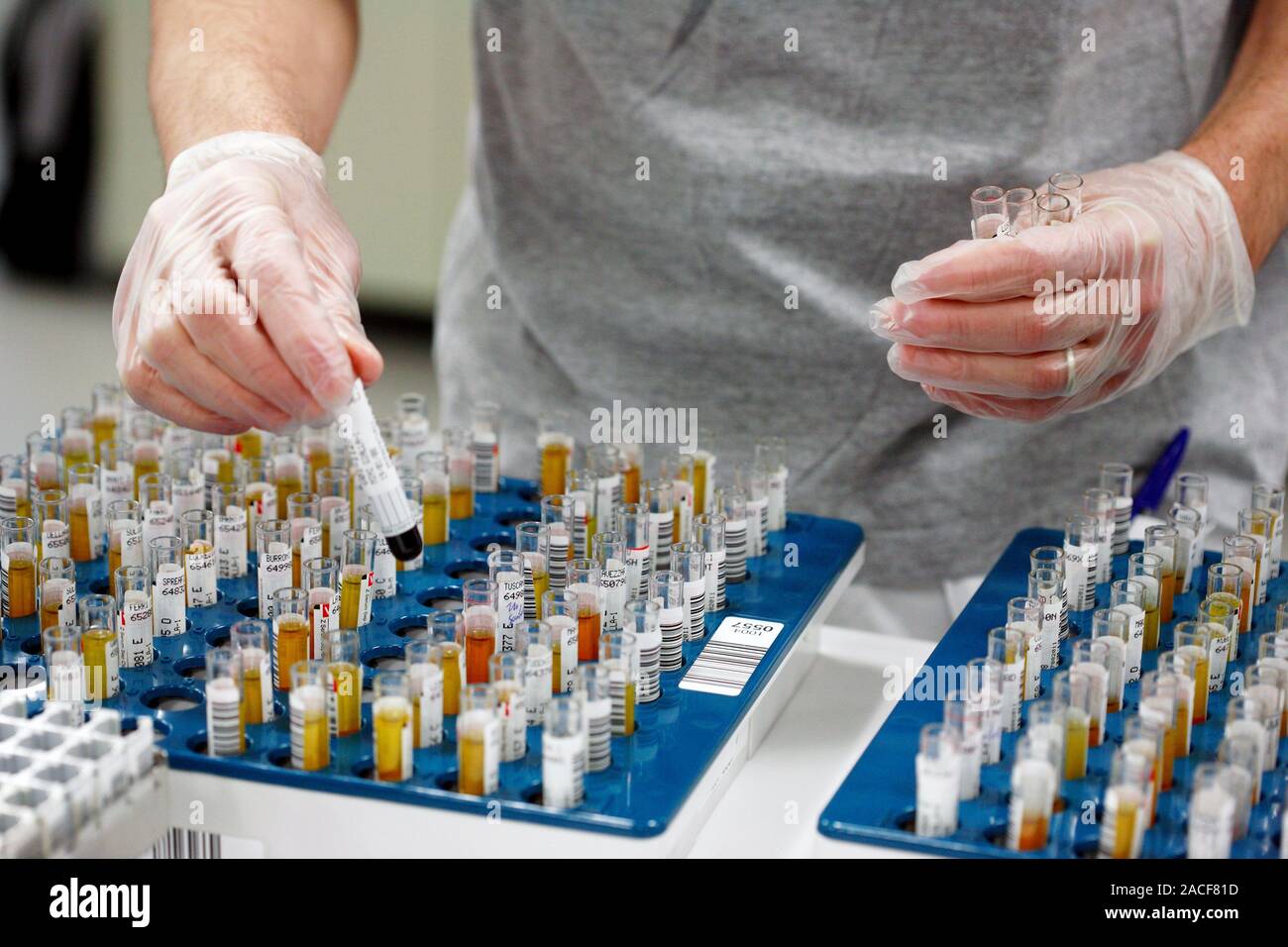 Blood samples being sorted by a technician in a haematology laboratory ...