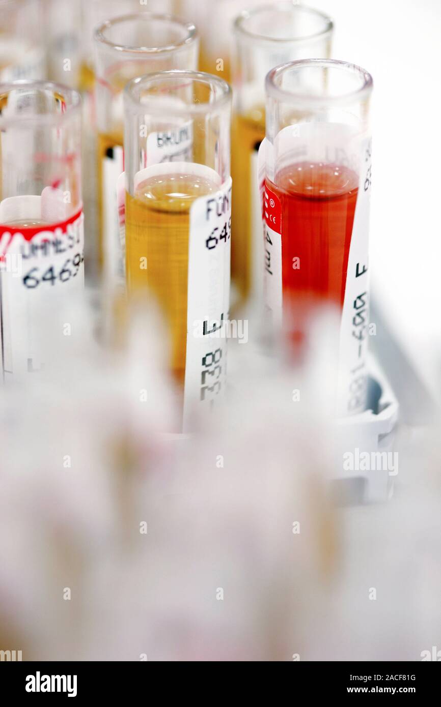 Blood samples in a haematology laboratory. The vacutainers are barcoded ...