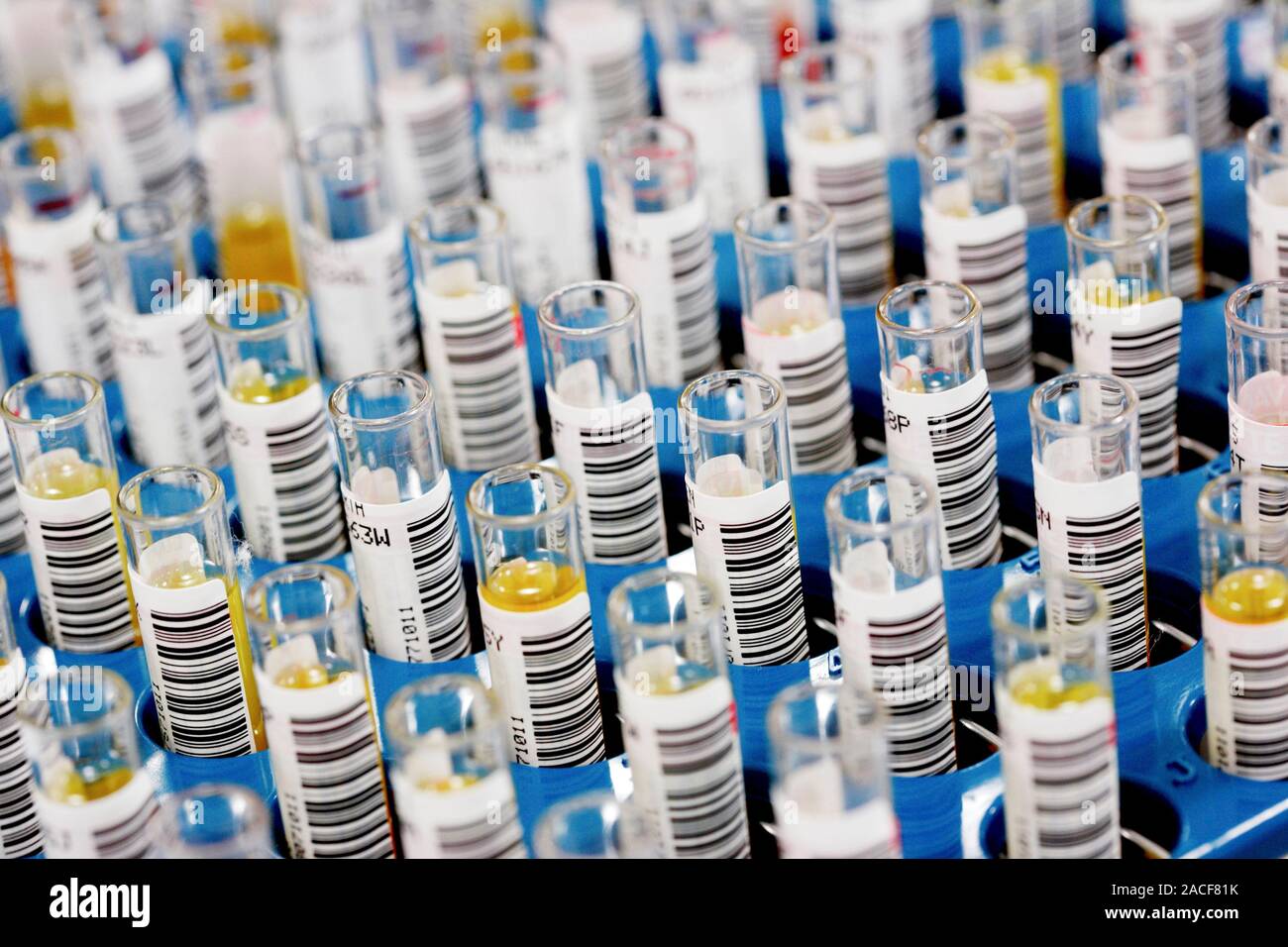Blood samples in a haematology laboratory. The vacutainers are barcoded ...