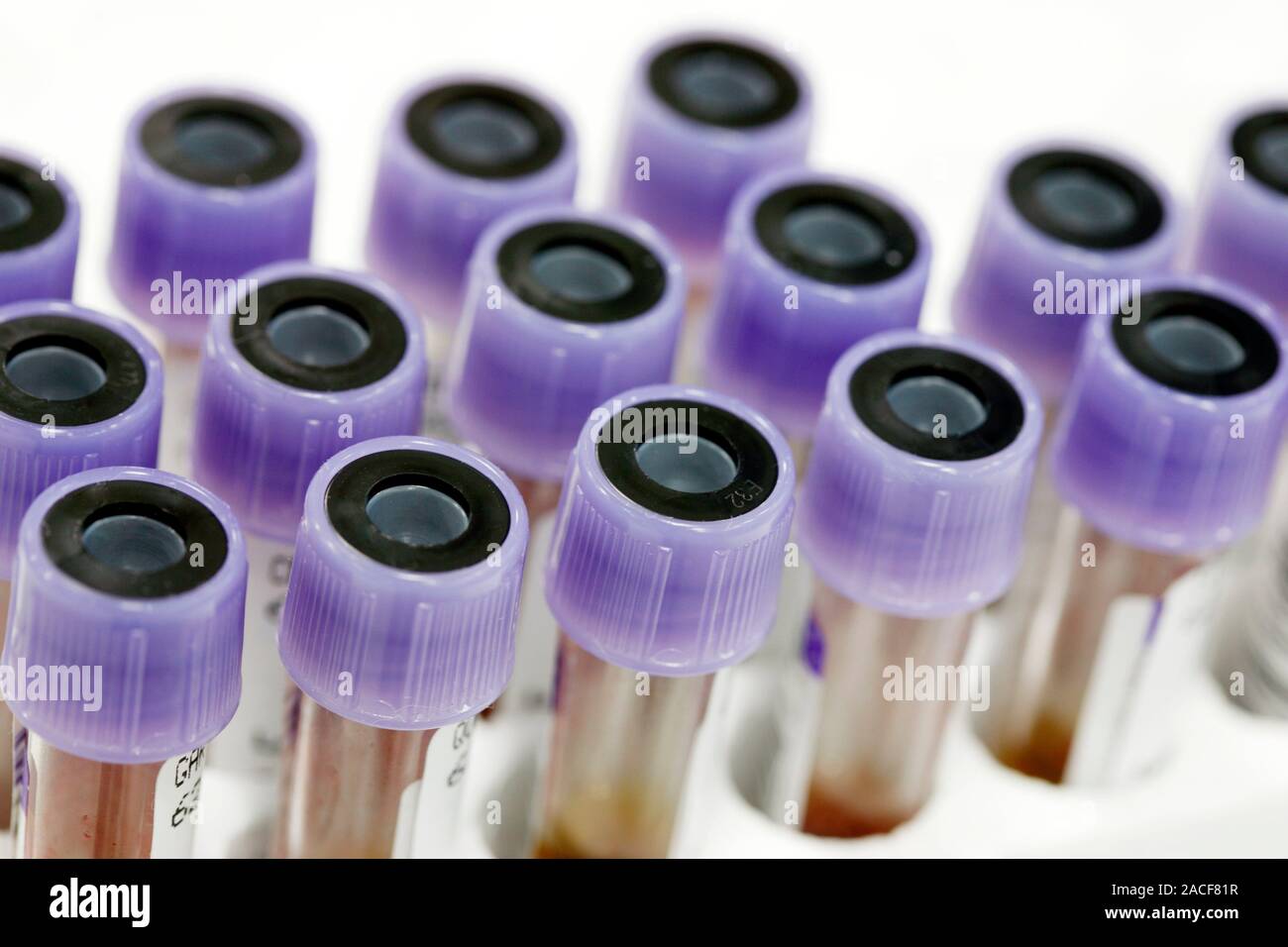 Blood samples in a haematology laboratory. The vacutainers have colour ...